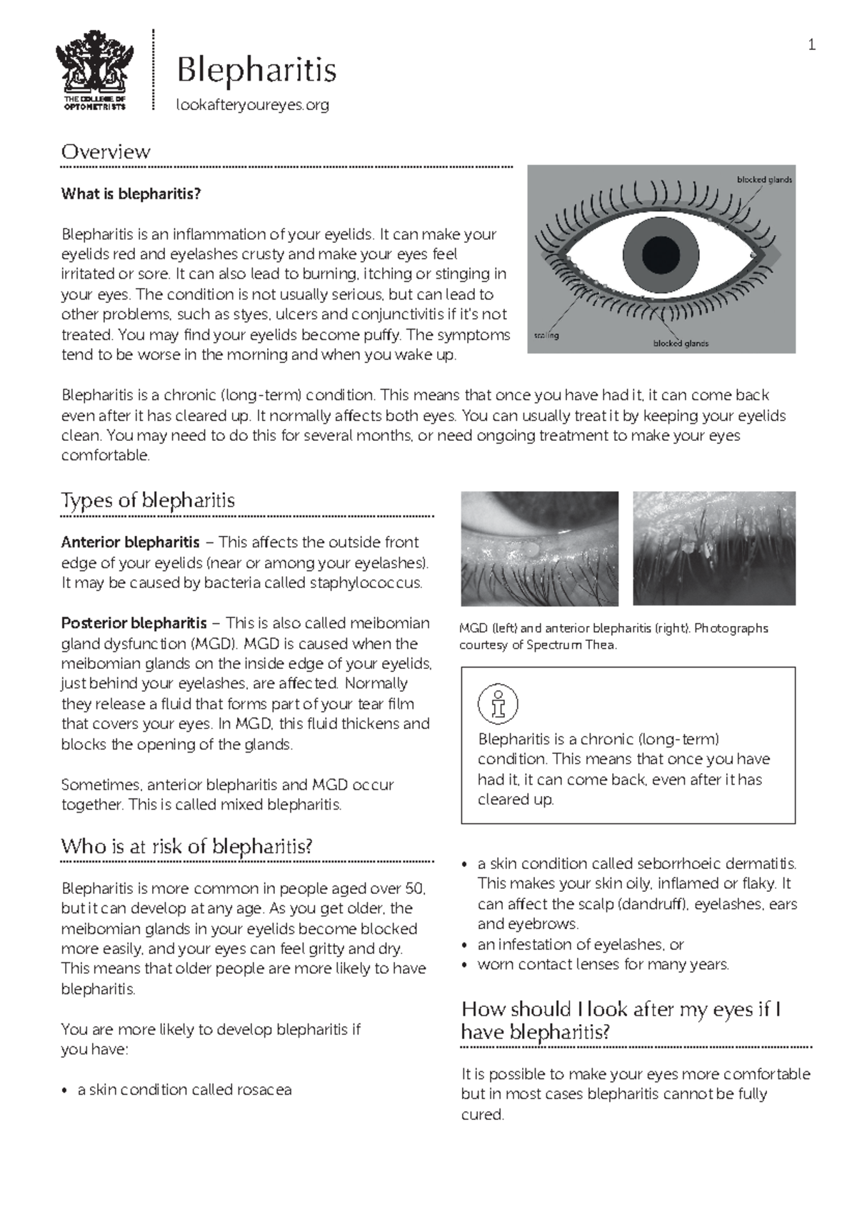 Bleph leaflet - 1 lookafteryoureyes Blepharitis Overview What is ...
