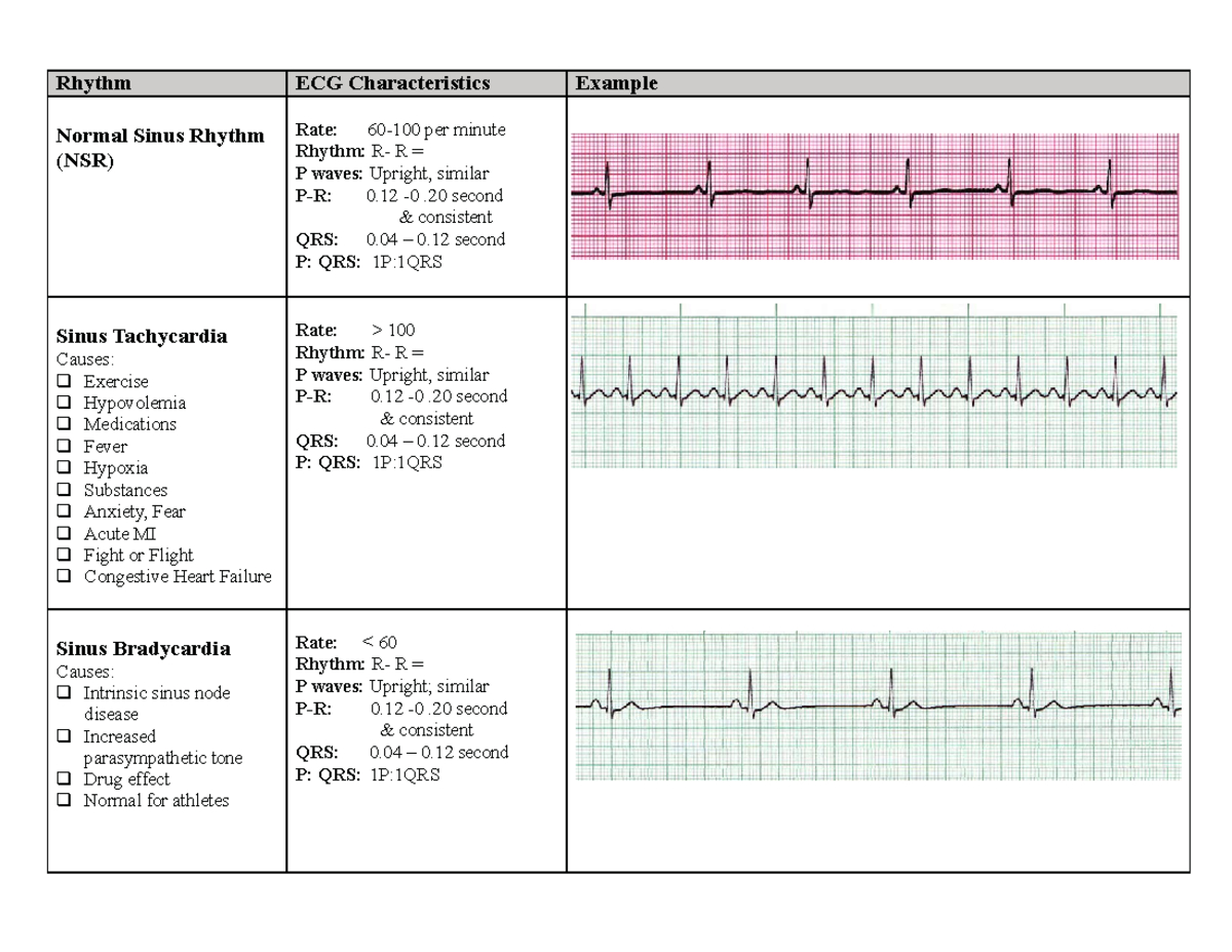 EKG Cheat Sheet - Key Rhythms and Clinical Significance - Studocu
