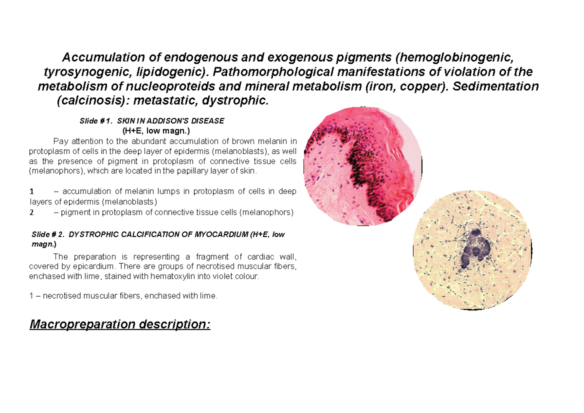 Album 5: Accumulation of Endogenous & Exogenous Pigments in Pathology ...