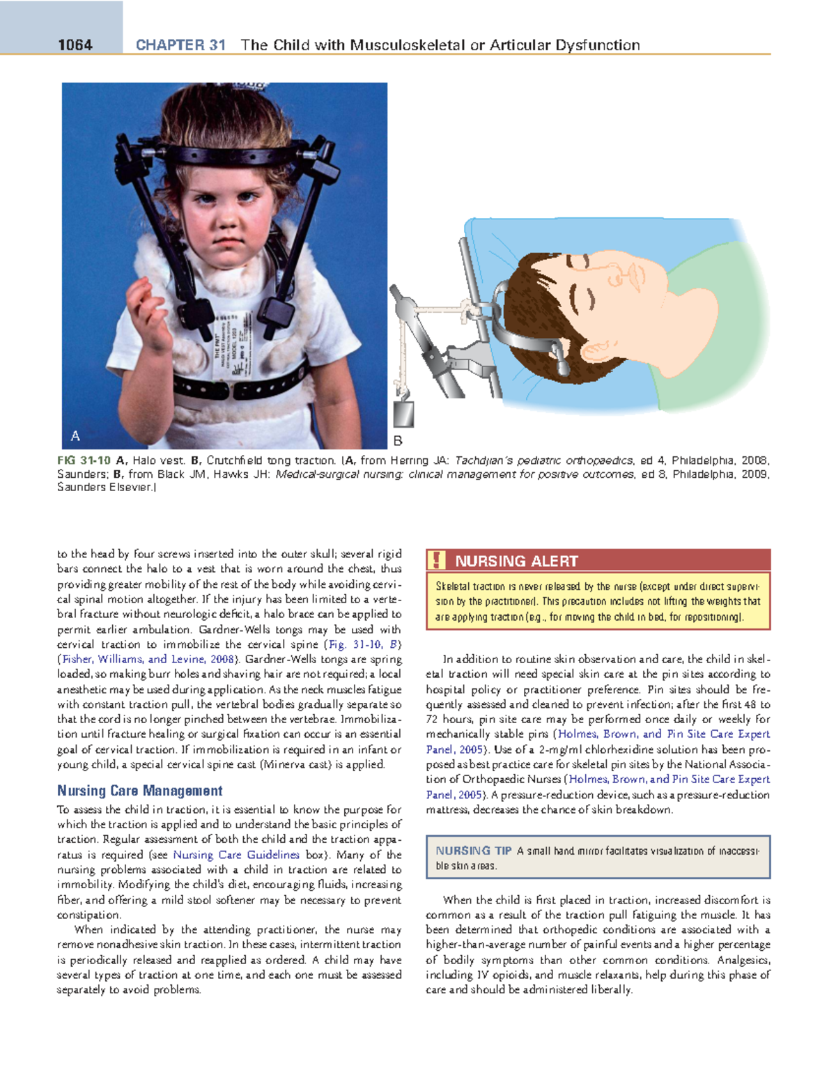 1064 CHAPTER 31: Pediatric Musculoskeletal Dysfunction & Traction Care ...
