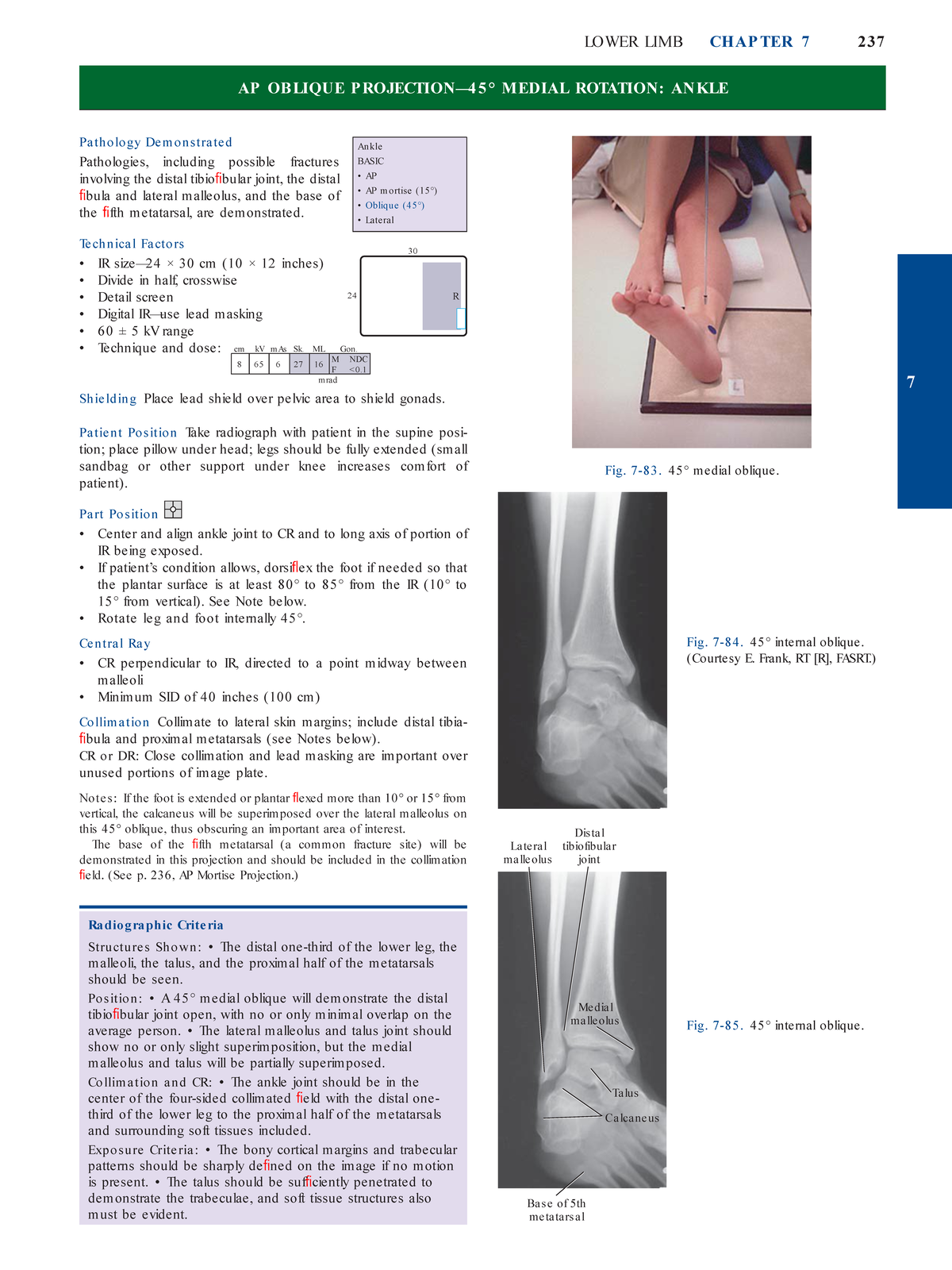 AP Oblique Projection—45° Medial Rotation for Ankle Imaging - Studocu