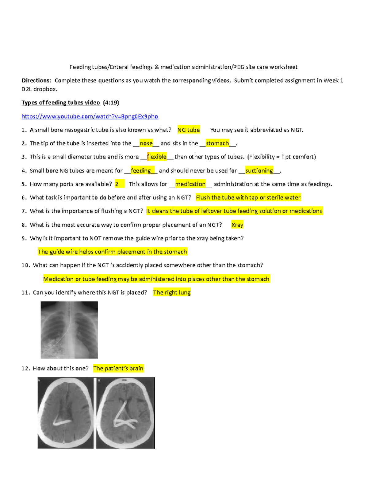 Feeding Tubes Worksheet & Answers for NURS 101: Week 1 Assignment - Studocu