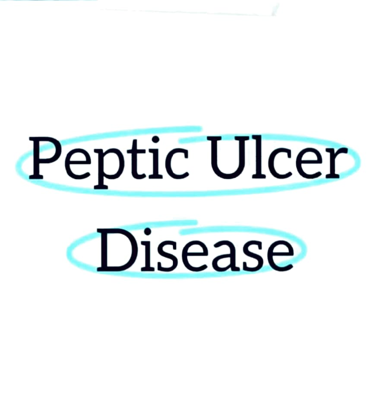 Peptic Ulcer Disease - Lecture Notes on Definition, Causes, and ...
