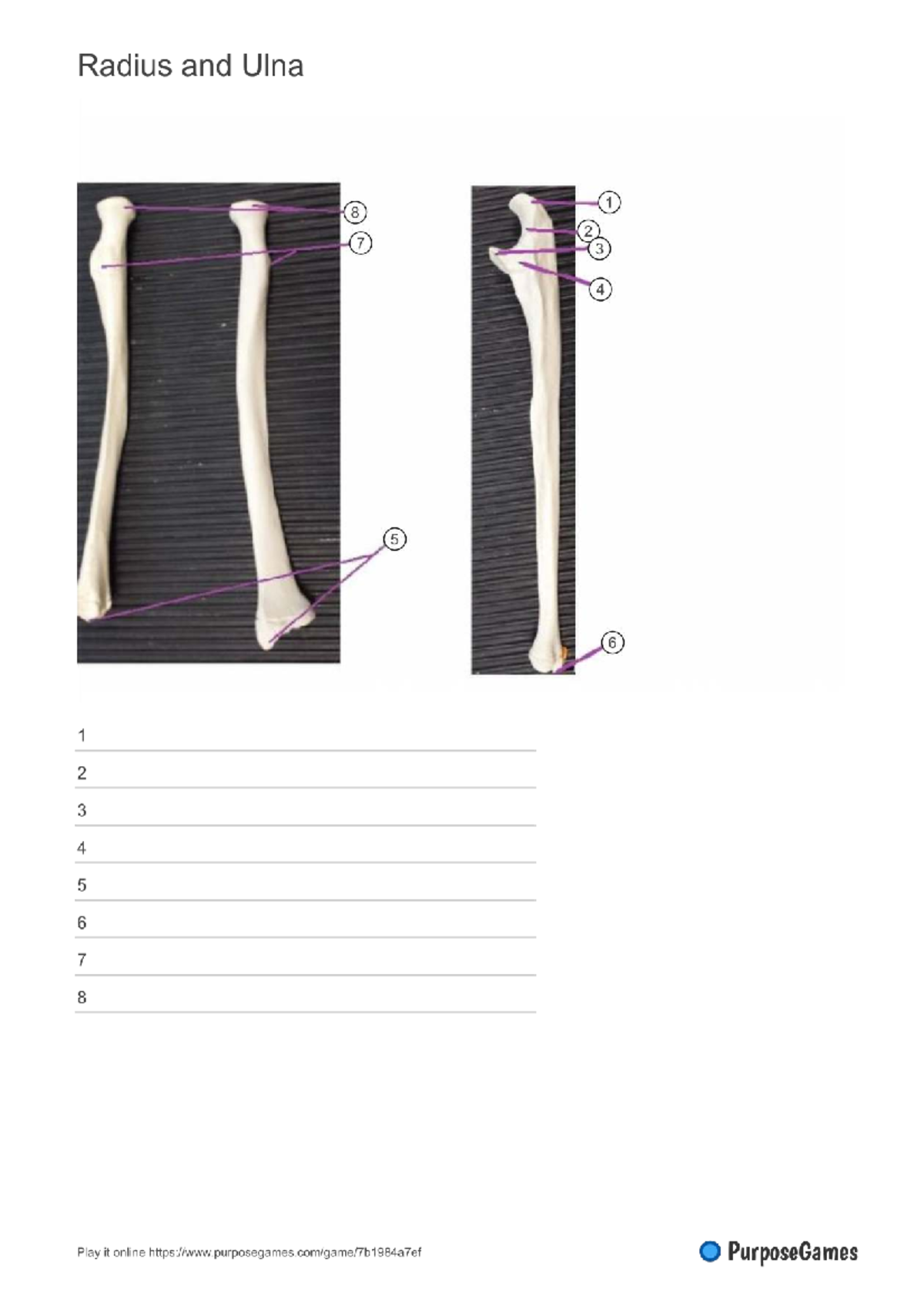 Worksheet-14 - practice sheet of the hip bones of the pelvis girdle - a ...