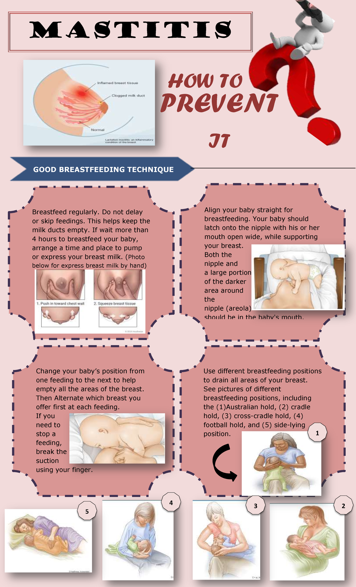Mastitis Prevention Techniques for New Mothers: Essential Tips - Studocu