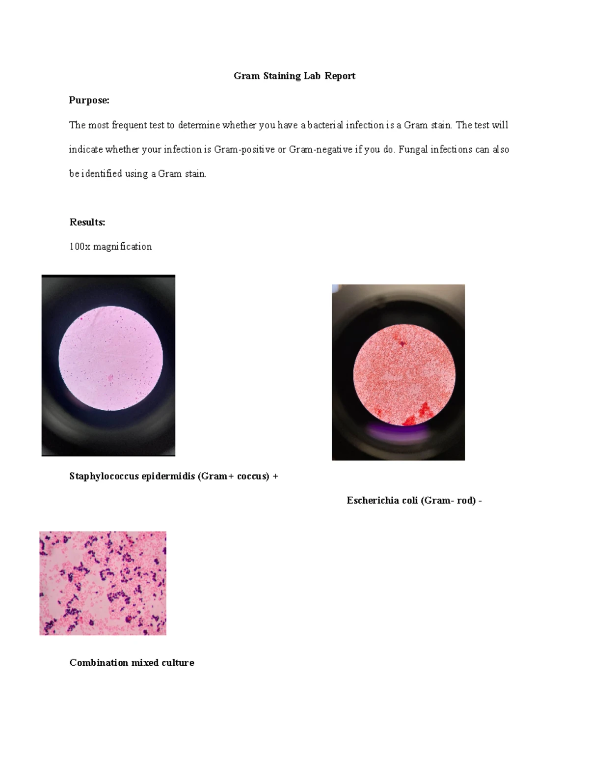 Lab 6 - Gram Staining Procedure and Analysis Report - Studocu