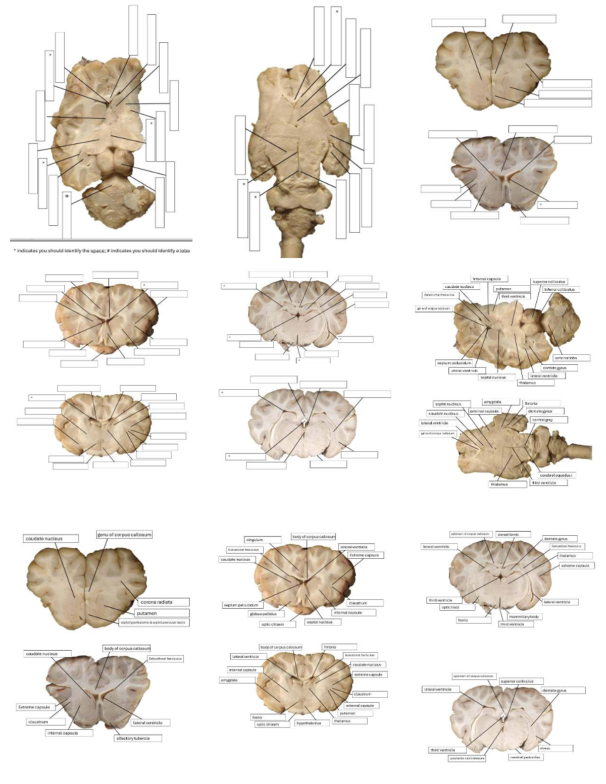 NROB60 Week 9: Neuroanatomy Structures Identification Guide - Studocu