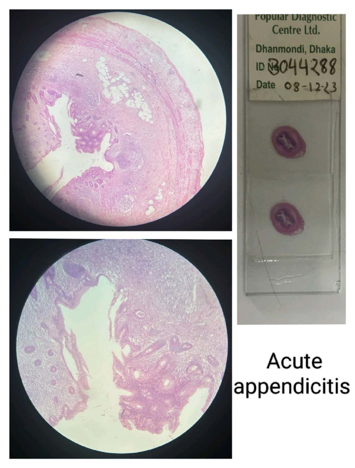 Pathology Term-1 OSPE: Diagnostic Findings & Procedures - Studocu