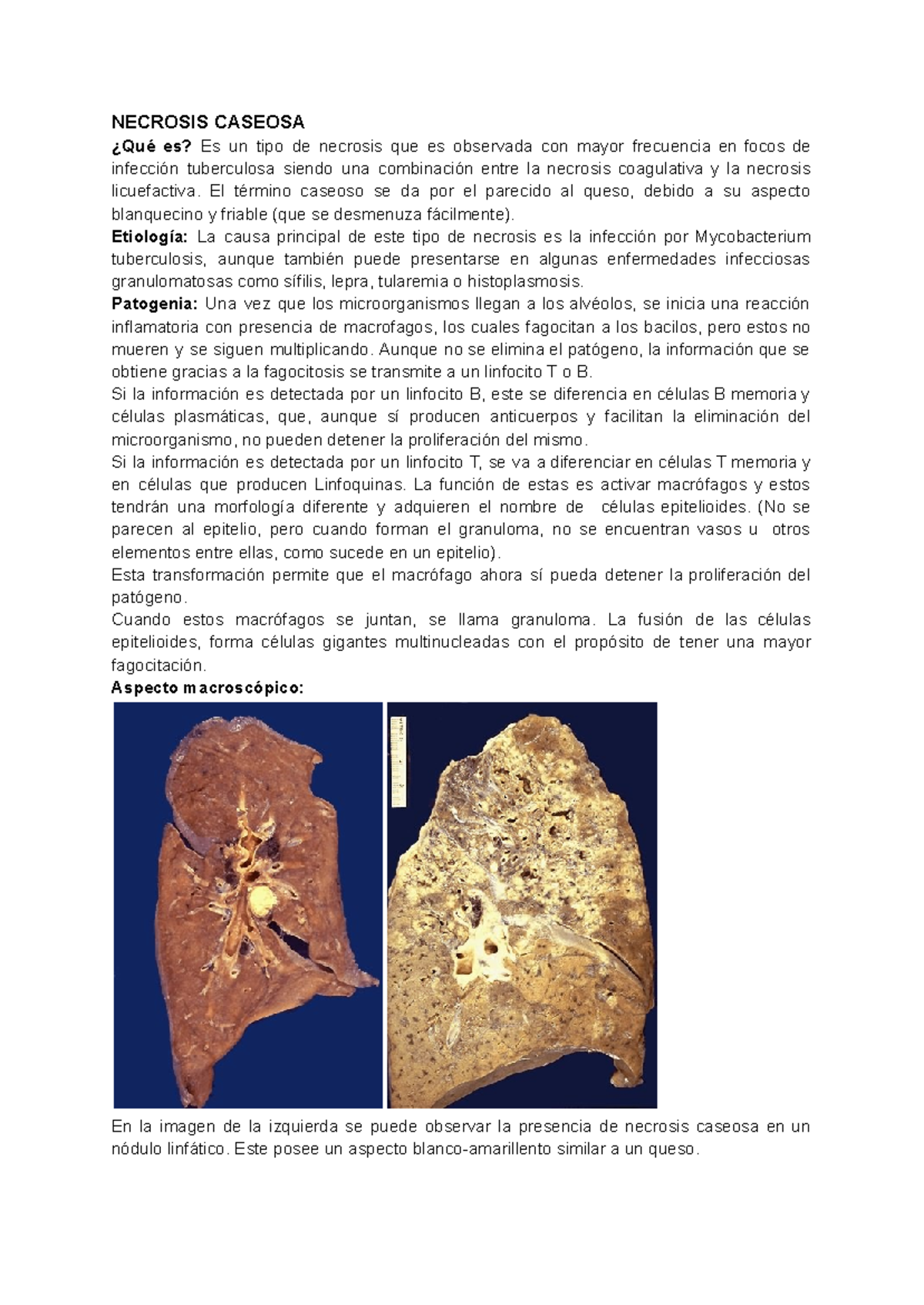 Necrosis Caseosa: Características, Etiología y Patogenia - Studocu