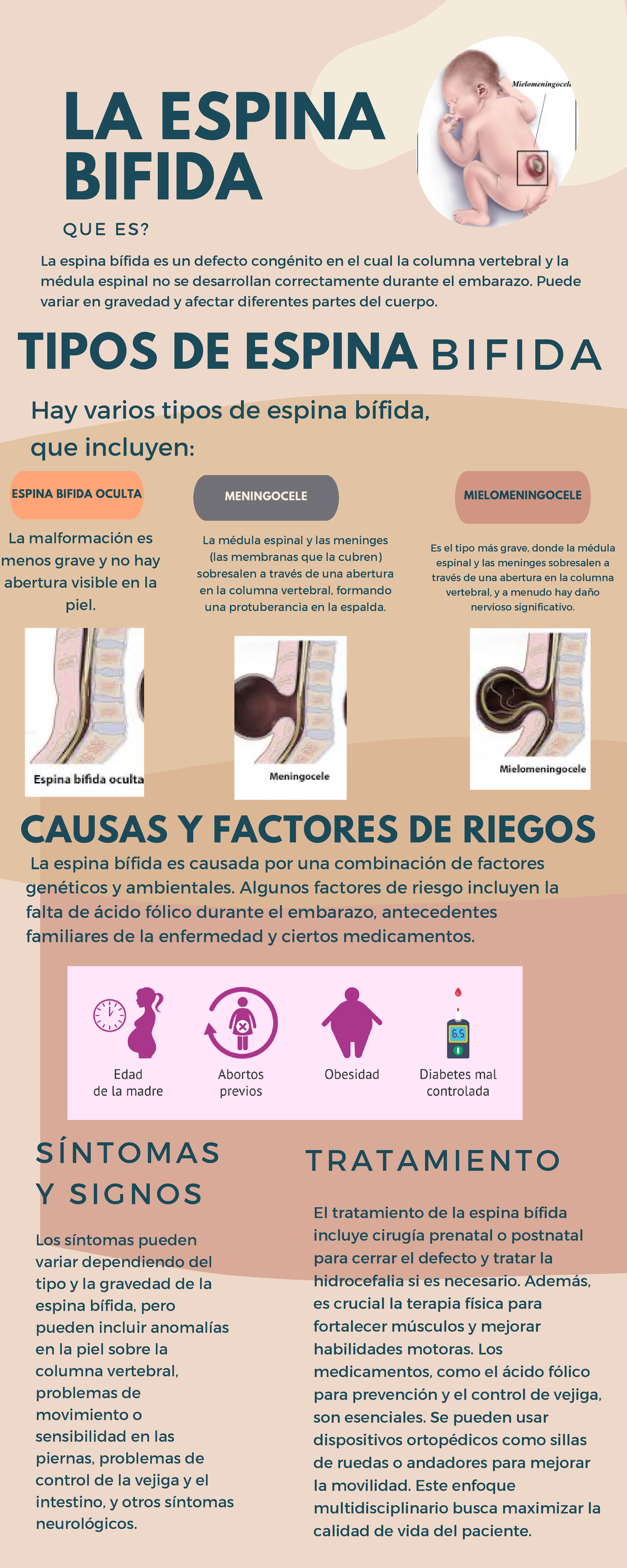 Infografía sobre Espina Bifida: Tipos, Síntomas y Tratamientos - Studocu