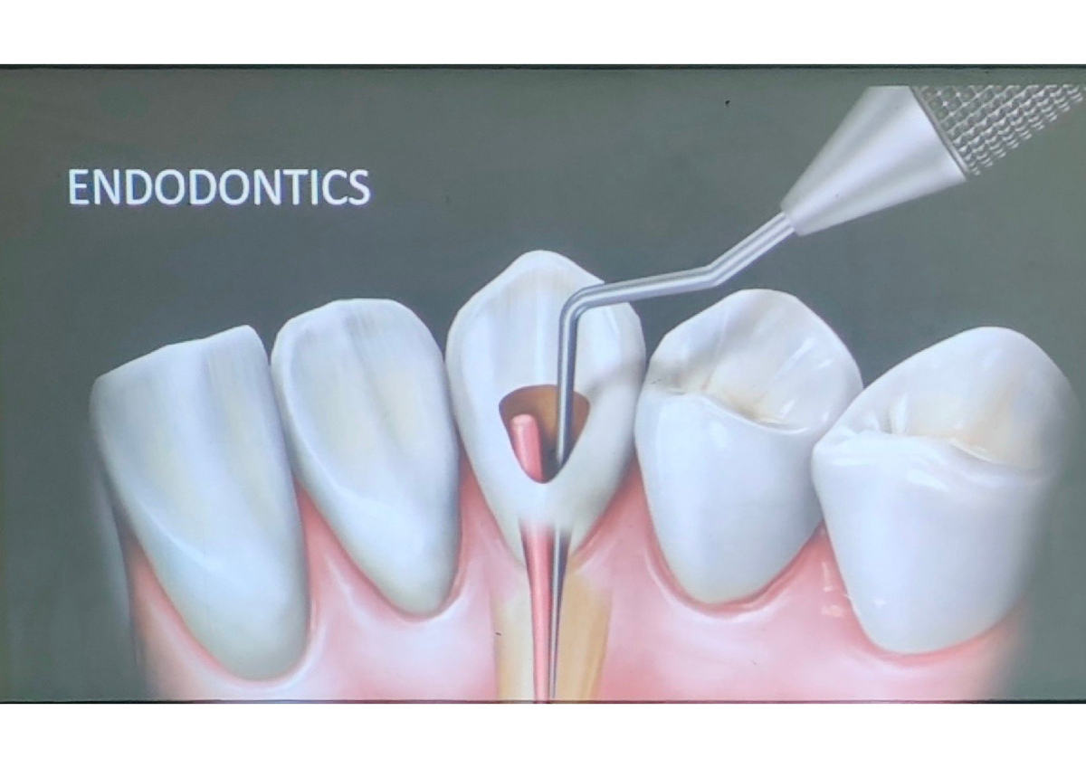 Endodontics Diagnosis: Comprehensive Guide for Final Exam (ENDO 101 ...