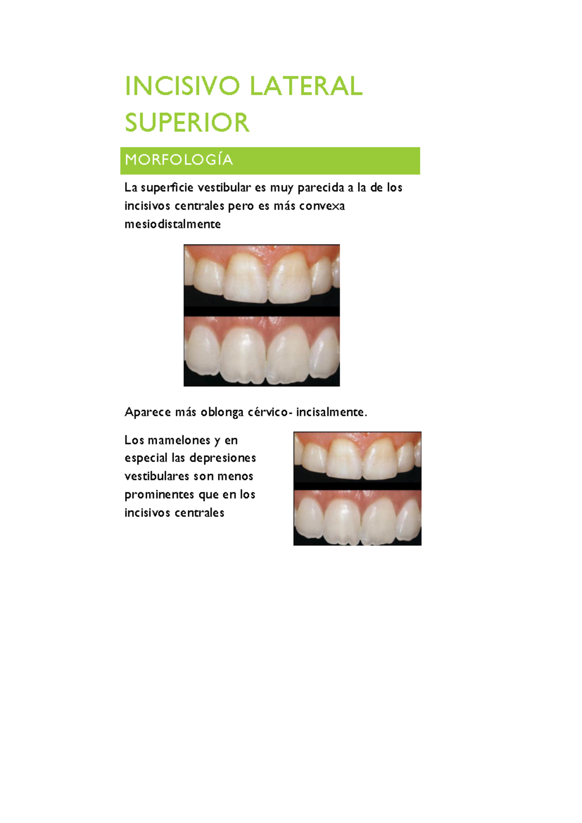 Incisivo Lateral Superior - INCISIVO LATERAL SUPERIOR MORFOLOGÍA La ...