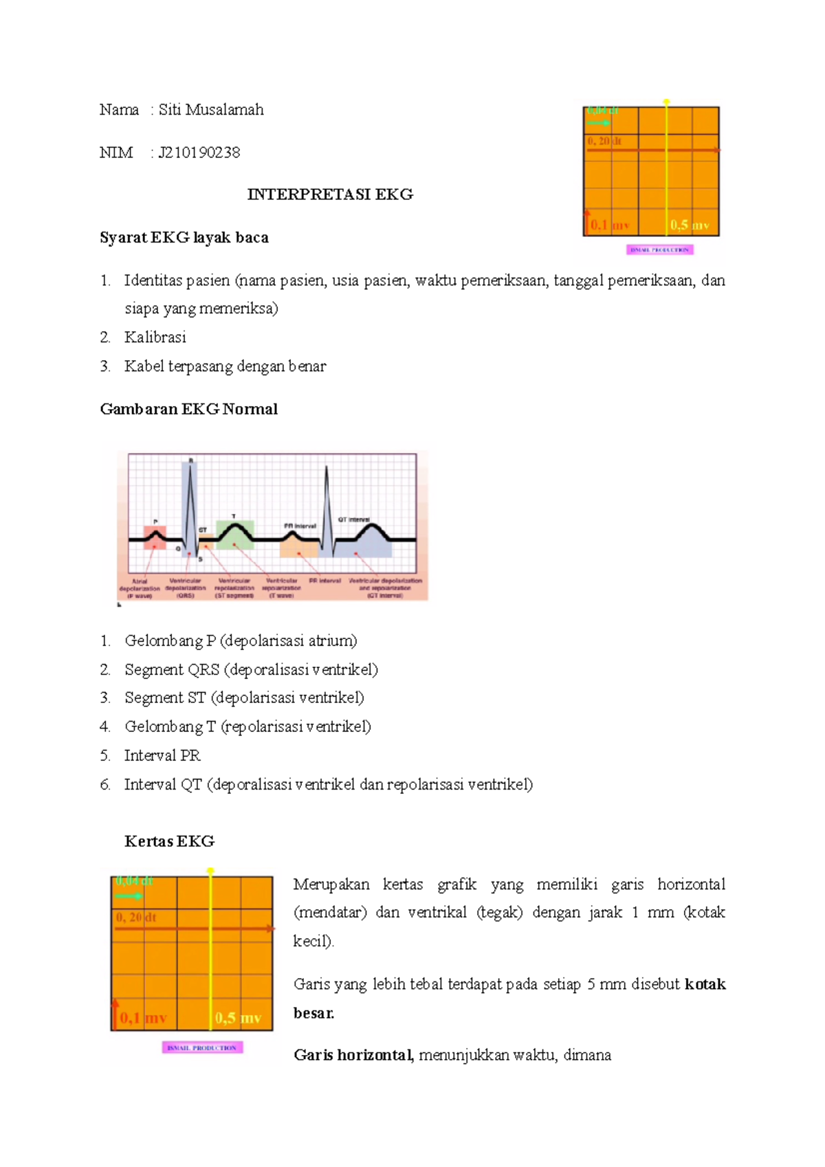 14. Interpretasi EKG: Panduan Lengkap untuk Siti Musalamah - Studocu