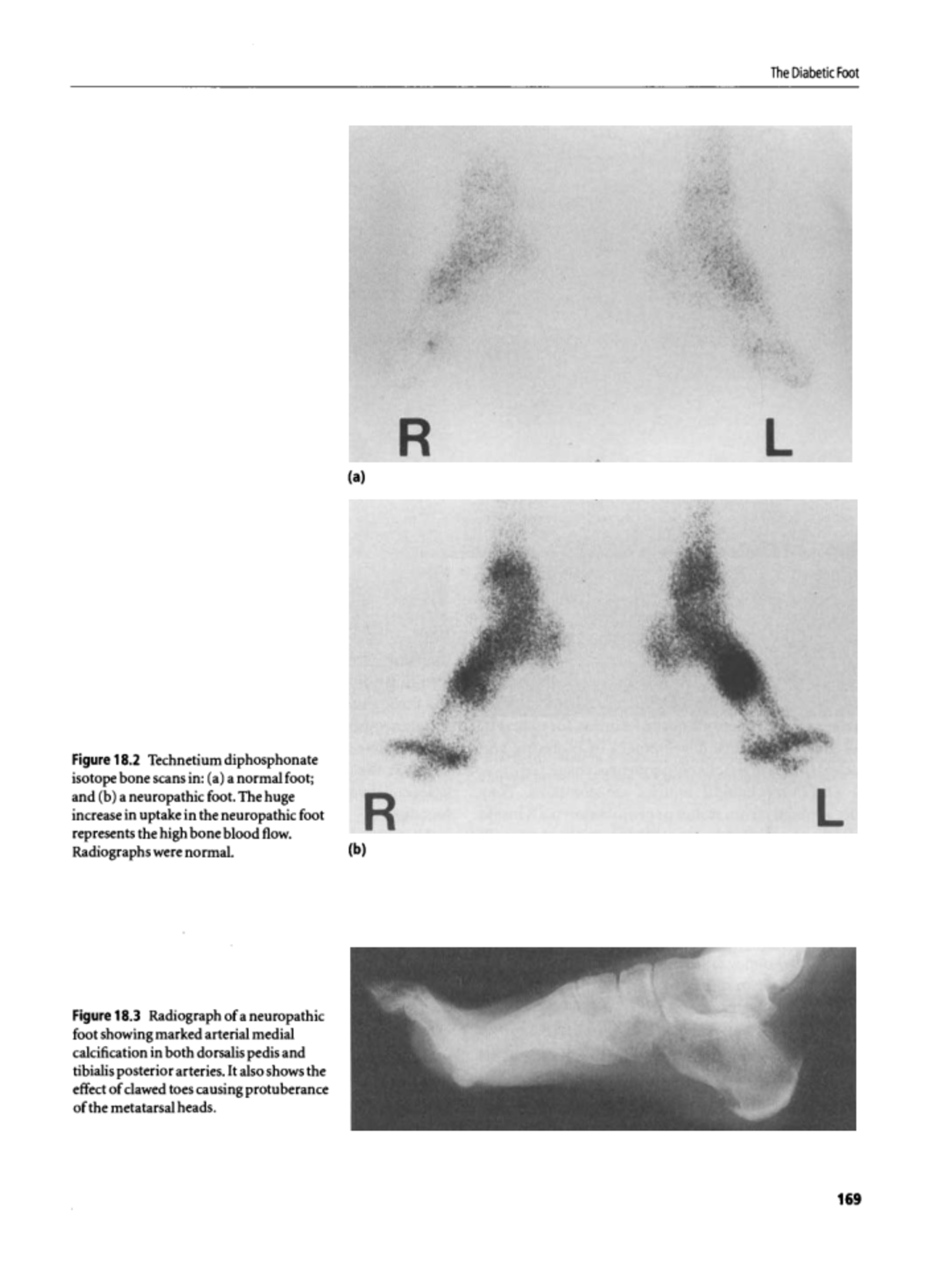 Healthop 2024: Diabetic Foot Imaging and Bone Scan Analysis - Studocu