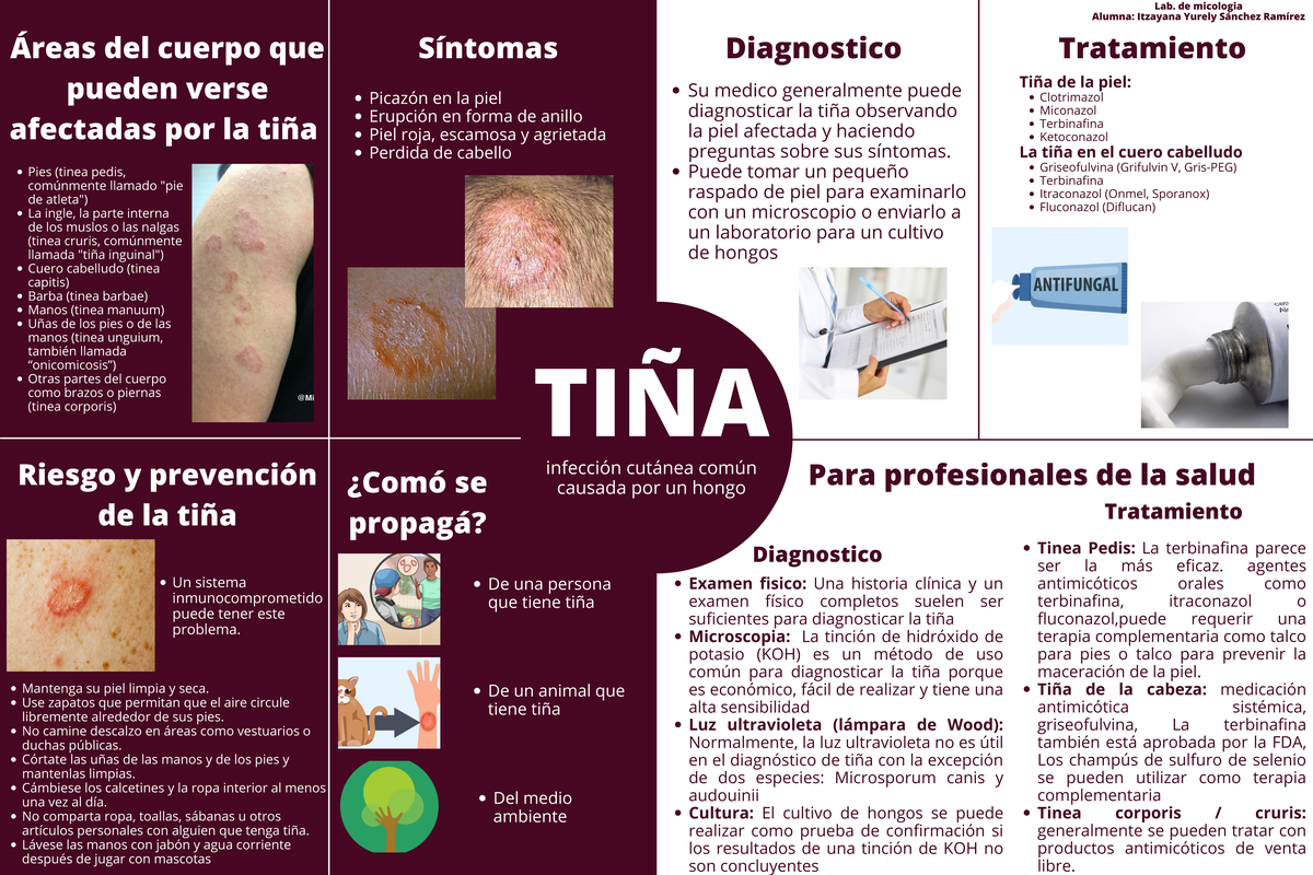 Tiña Cartel - Apuntes 1 - TIÑA infección cutánea común causada por un ...