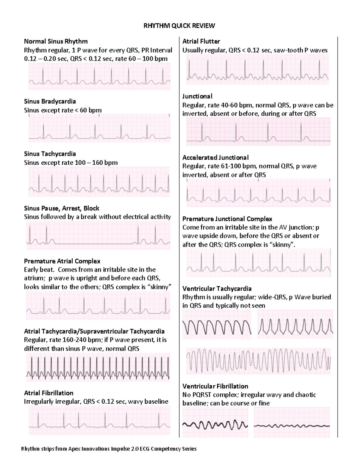 Apex Innovations ECG Rhythm Strips Quick Review Guide - Studocu