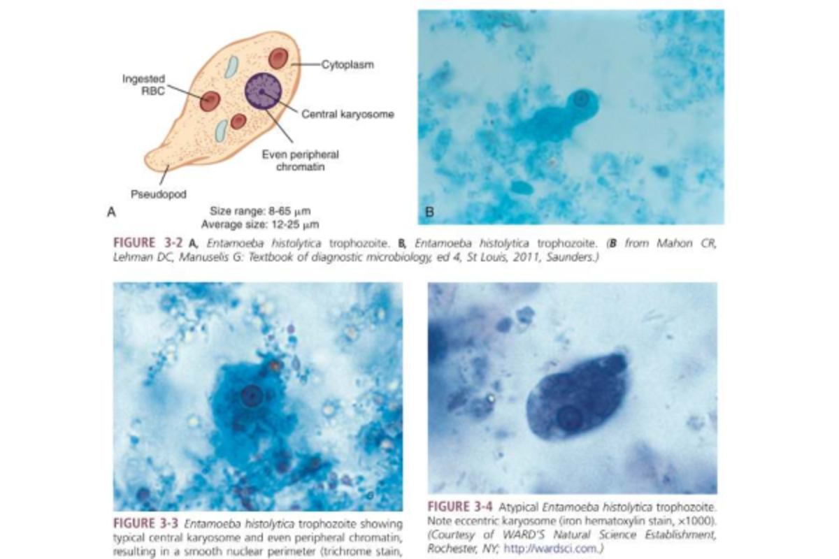 Parasitology Pictures Compilation: Entamoeba & Other Protozoa (BIO 101 ...
