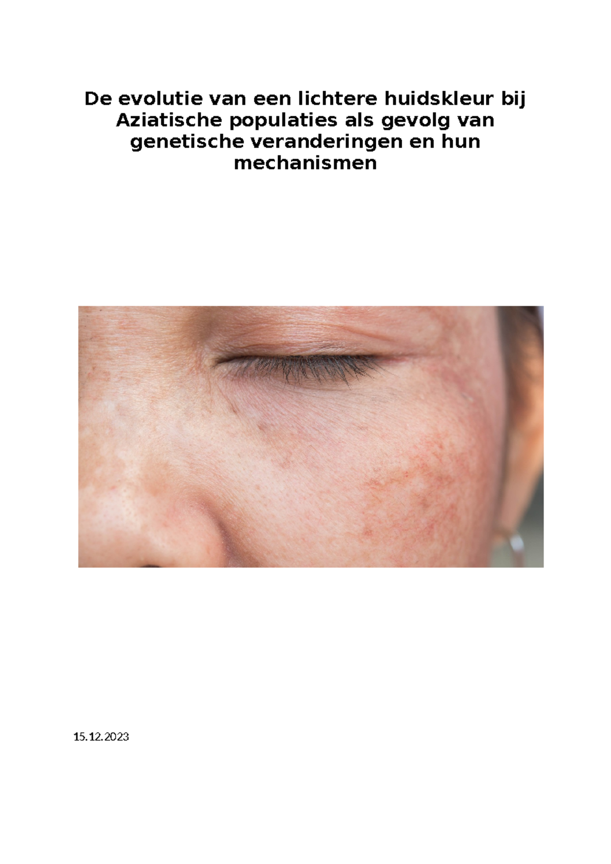 Themaopdracht: Evolutie van Lichte Huidskleur bij Oost-Aziaten en ...