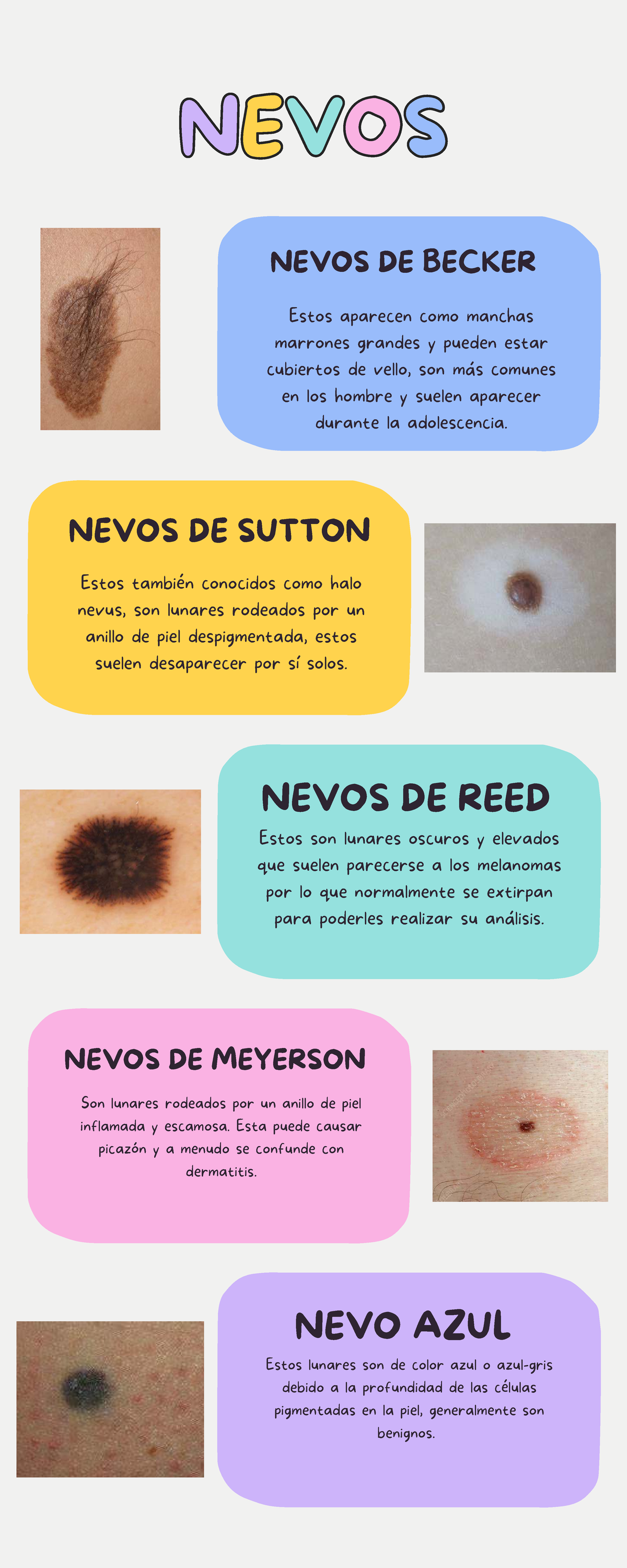 Tipos de Nevos: Características y Clasificación - Studocu