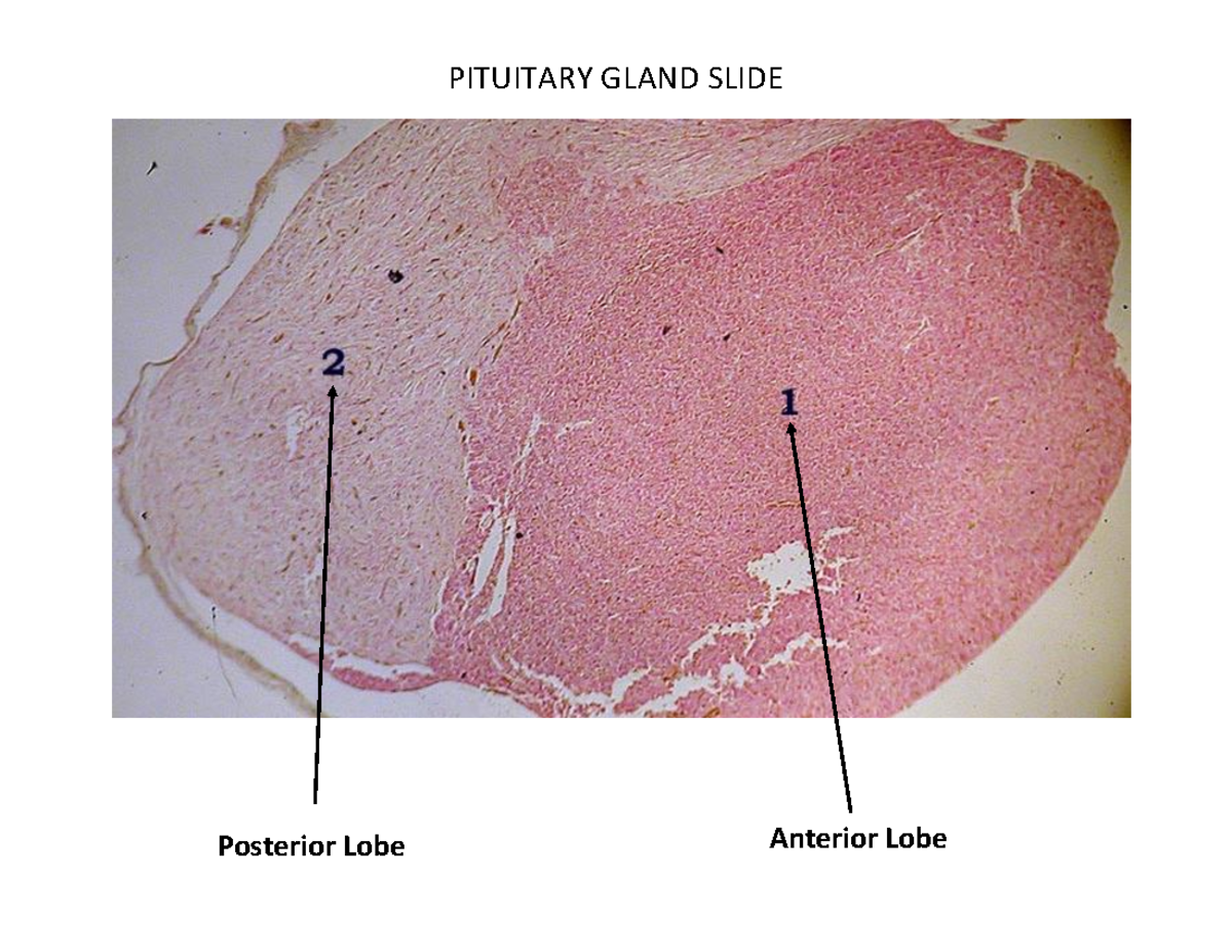 Biol-158-Uniit-1 - lab notes - PITUITARY GLAND SLIDE Posterior Lobe ...