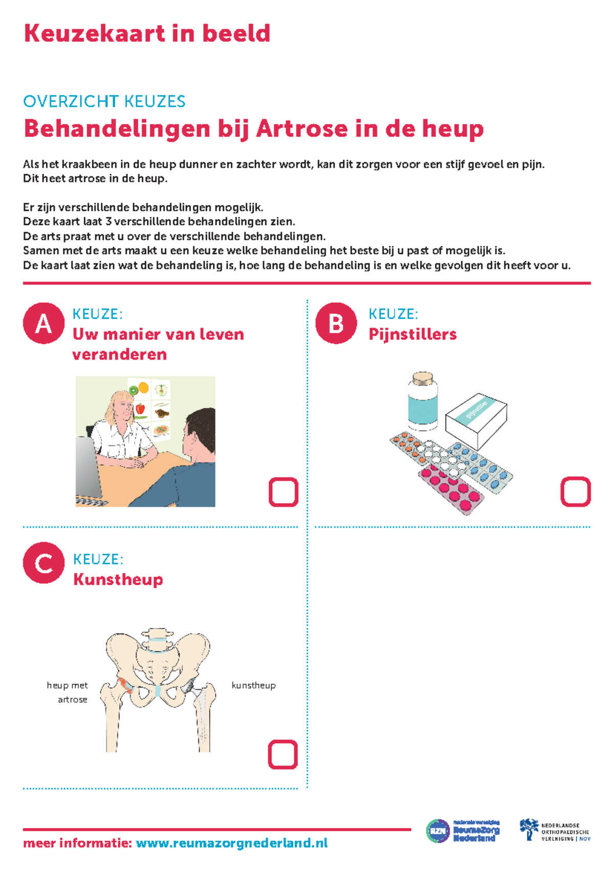 Keuzekaart Behandeling bij Heupartrose: Kunstheup & Pijnstillers ...