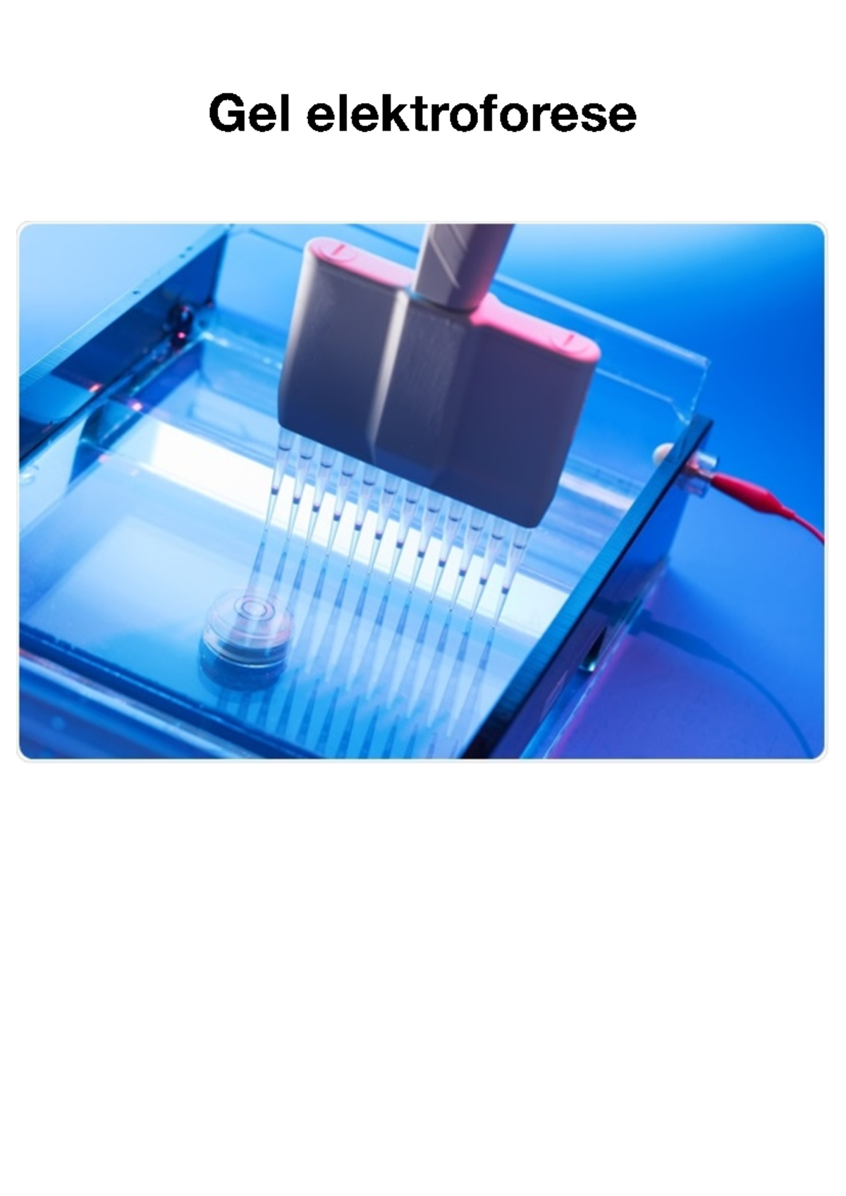 Verslag Gel Elektroforese: Onderzoek naar CF Ziektevarianten - Studeersnel