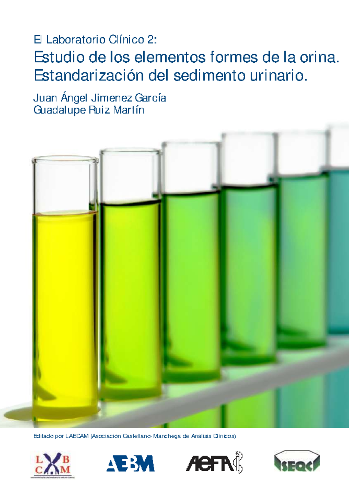 Estudio de Elementos Formes de la Orina y Estandarización del Sedimento ...