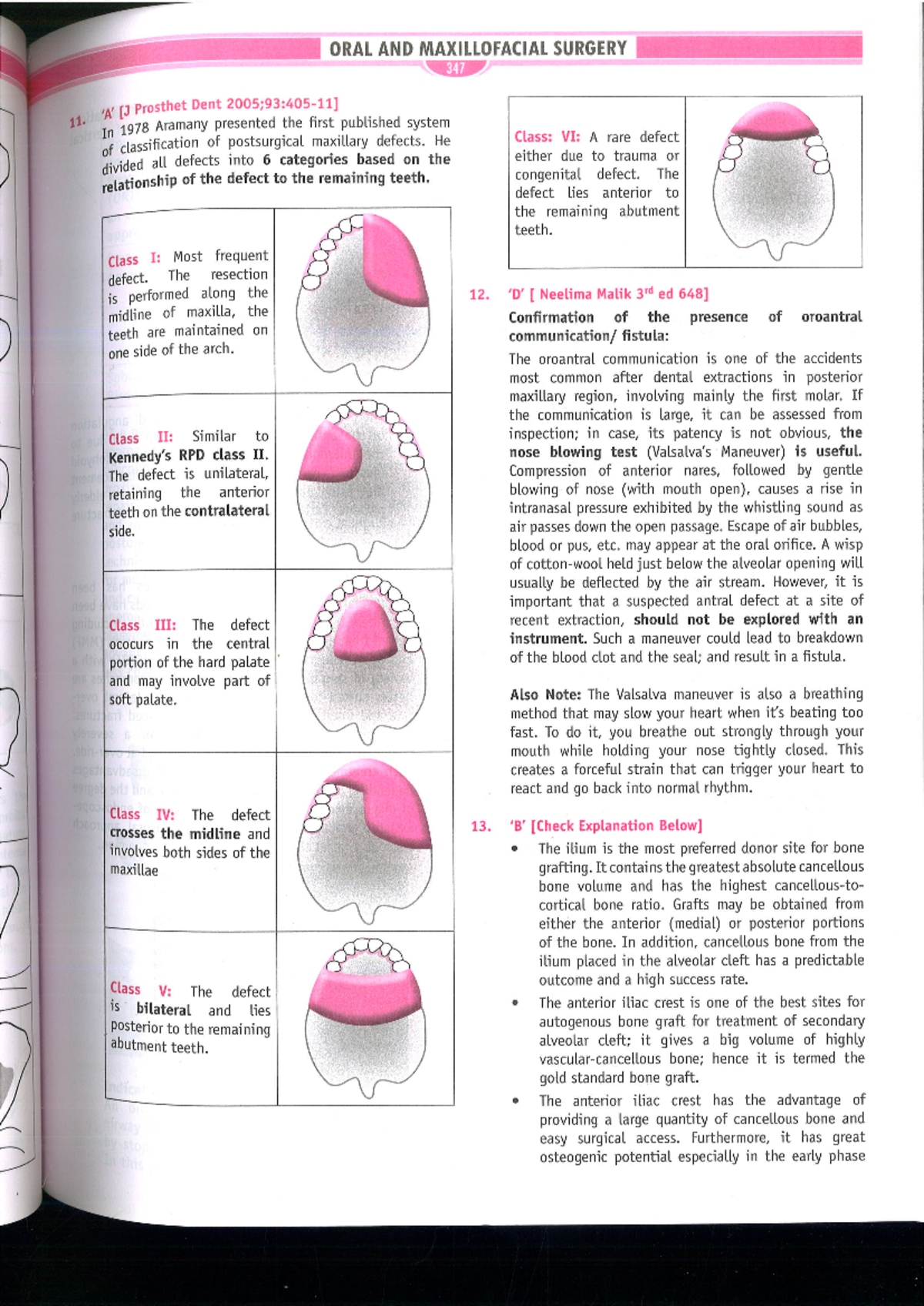ORAL AND MAXILLOFACIAL SURGERY 347: Classification of Maxillary Defects ...