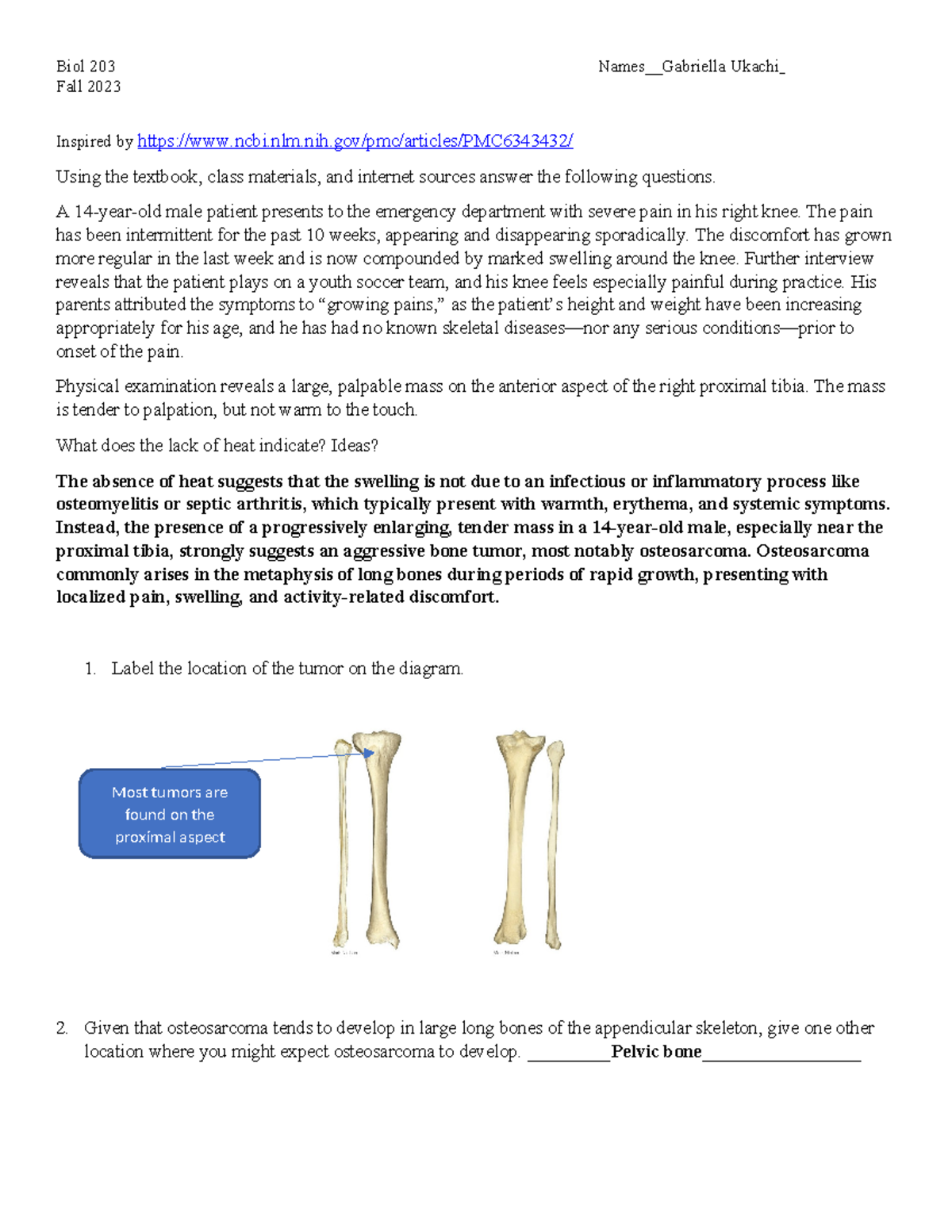 Quiz 3 Skeletal Tissue-Case Study - Fall 2023 Inspired by ncbi.nlm.nih ...