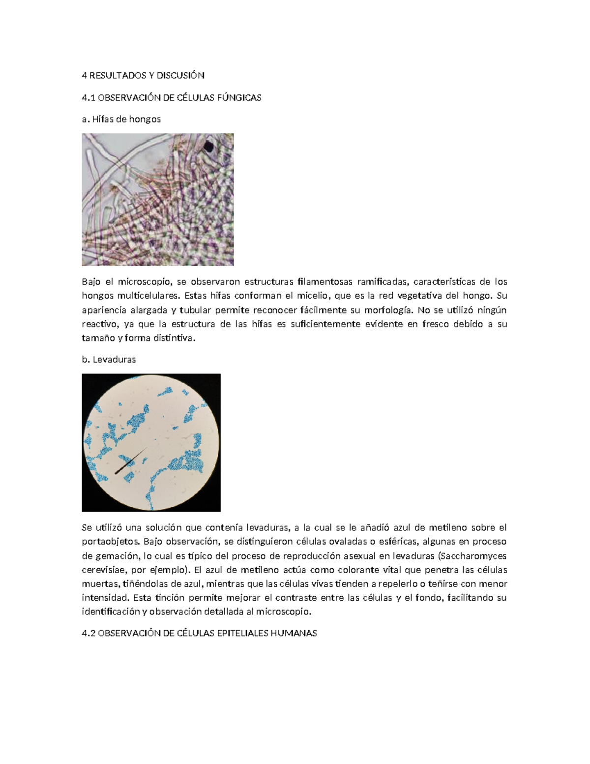 Resultados y Discusión de Observaciones Microscópicas en Biología 4.1-4 ...
