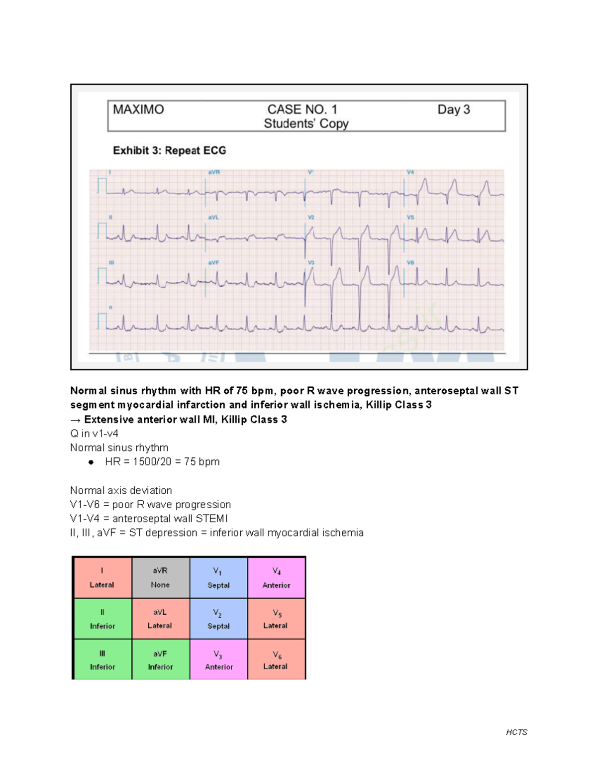 HOW TO READ ECG - ECG reading - Normal sinus rhythm with HR of 75 bpm ...