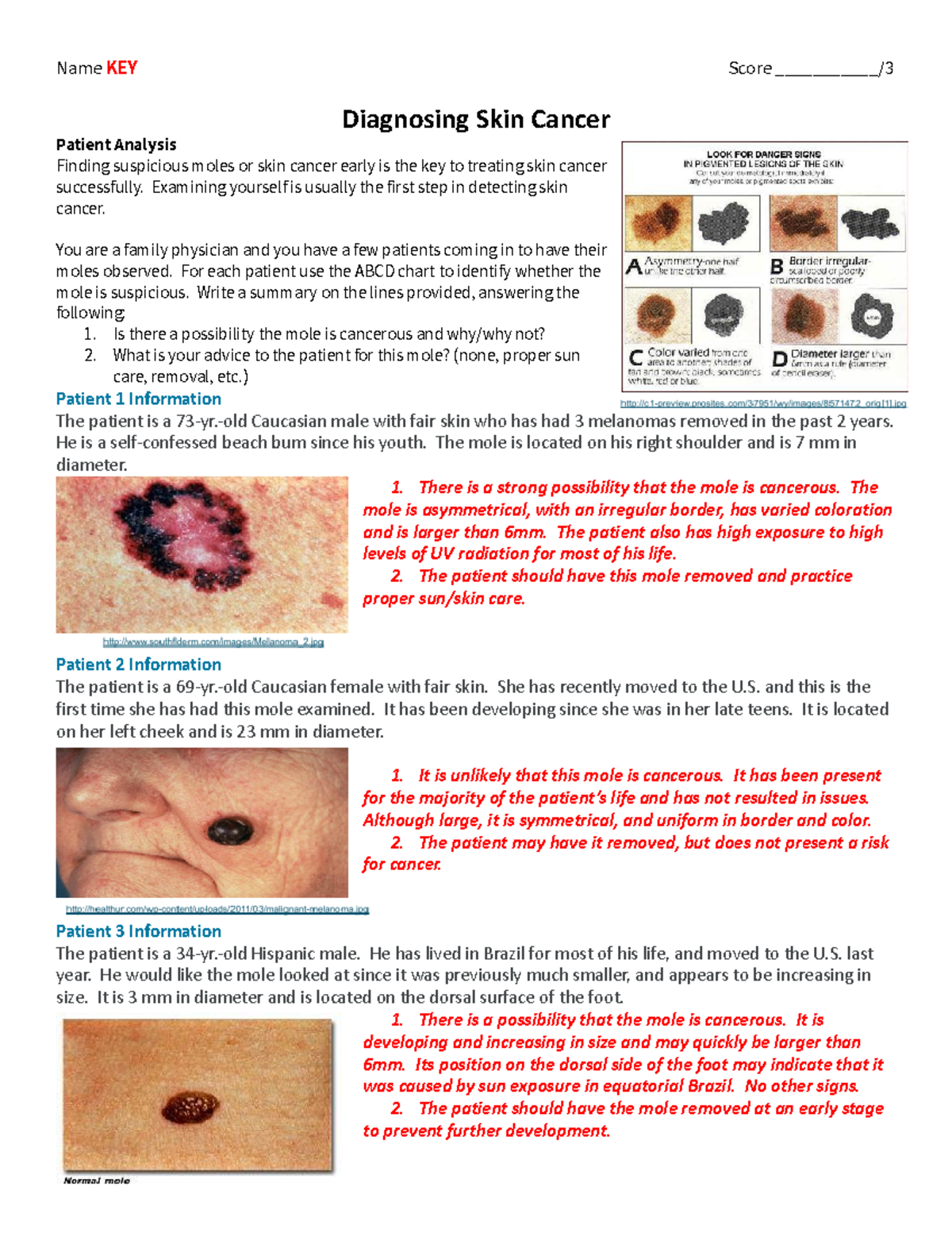 Diagnosing Skin Cancer: Patient Analysis Summary Key - Studocu
