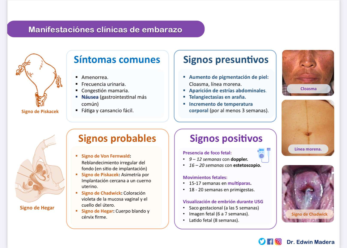 Flashcards de Obstetricia: Signos y Manifestaciones Clínicas del ...
