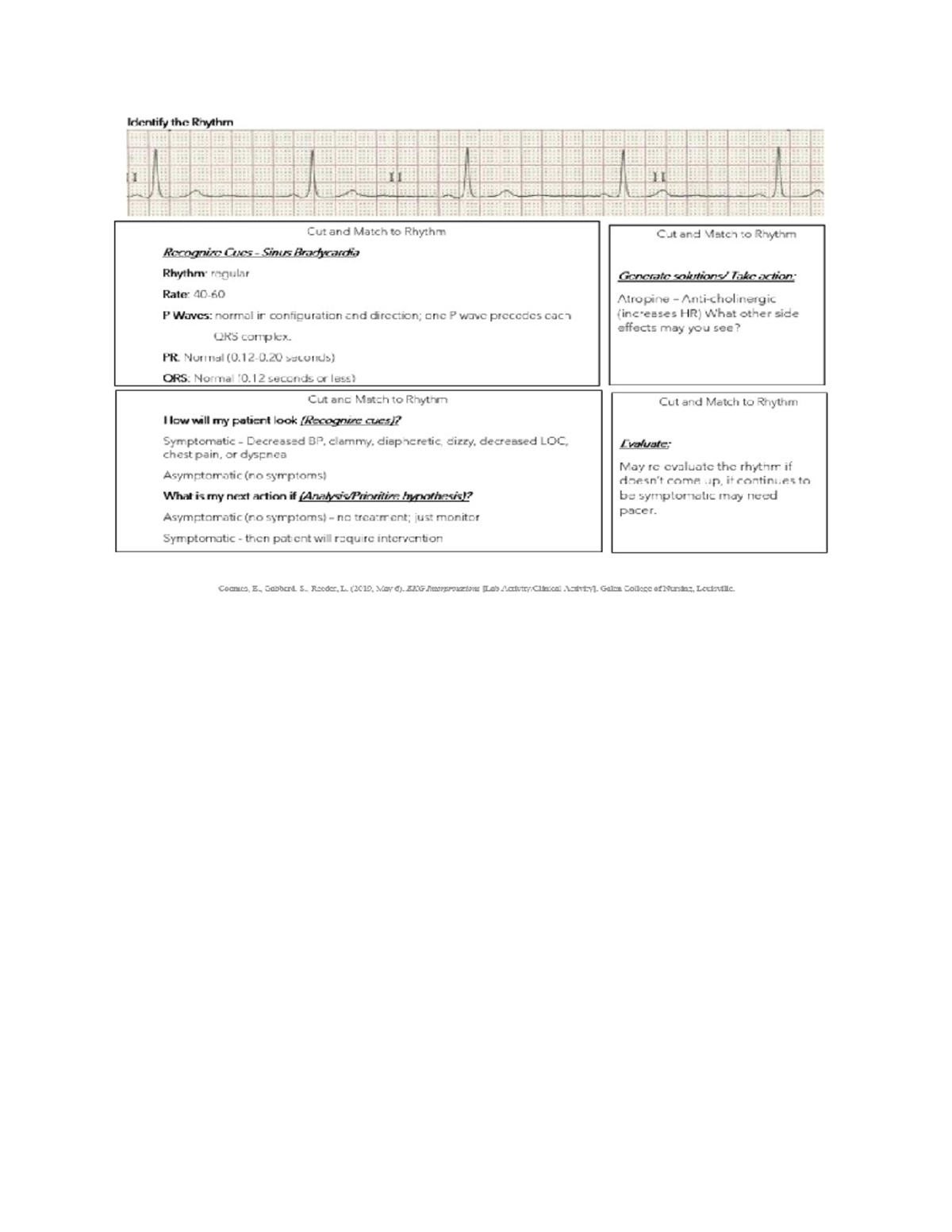 EKG+strips+with+explanations - Identify the Rhythm II Cut and Match to ...