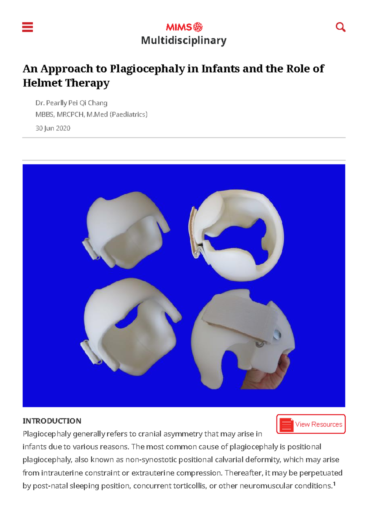 Approach to Infant Plagiocephaly: Evaluating Helmet Therapy Options ...
