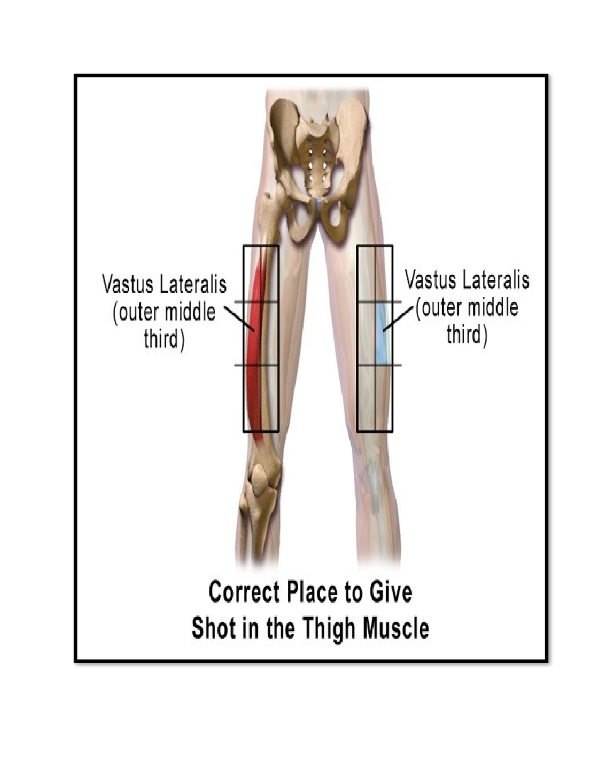 Vastus Lateralis - Lab material - NSG 201C - Vastus Lateralis Vastus ...
