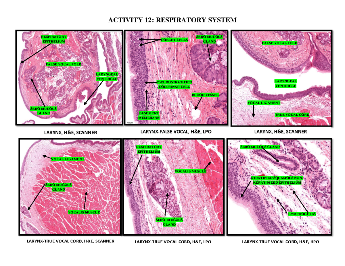 Histopathology of the Respiratory System: Larynx to Bronchi (H&E) - Studocu