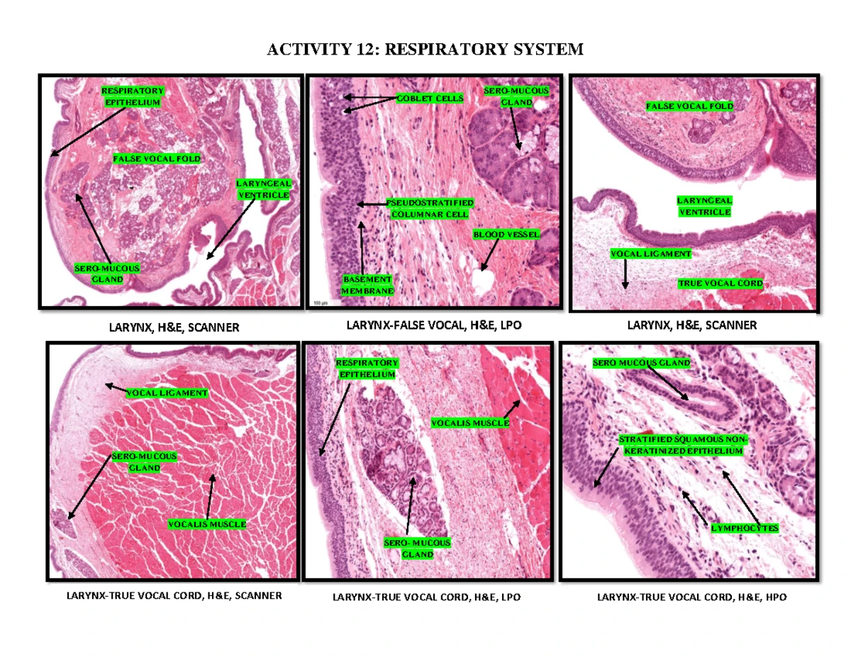16 Types OF Tissues - lesson - 16 TYPES OF TISSUES Human Cardiac Muscle ...