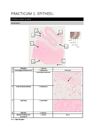 Epitheelweefsel - 2 kanten - Apicaal: bovenkant - Basaal: onderkant ...