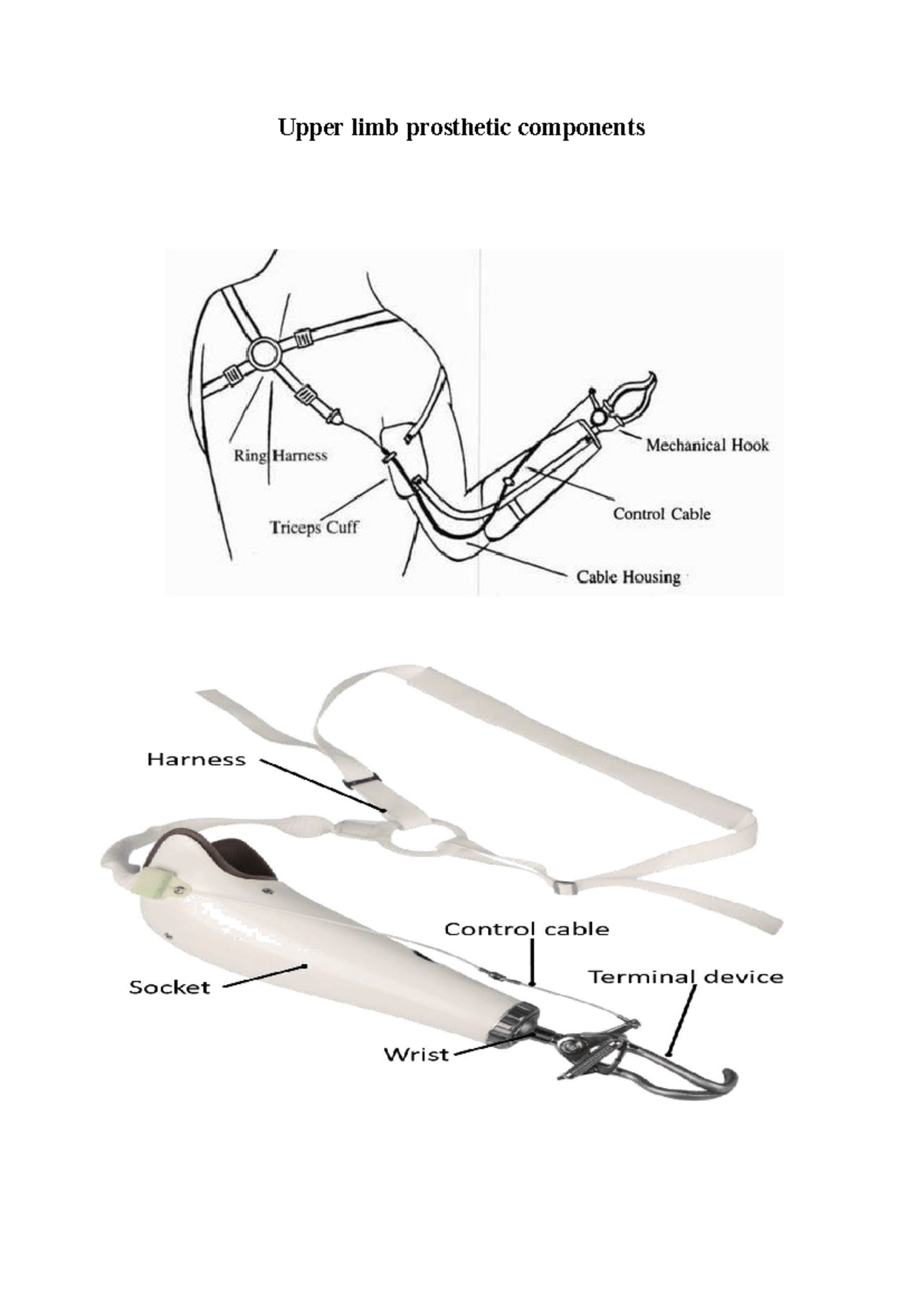 Upper Limb Prosthetic Components: A Comprehensive Overview - Studocu