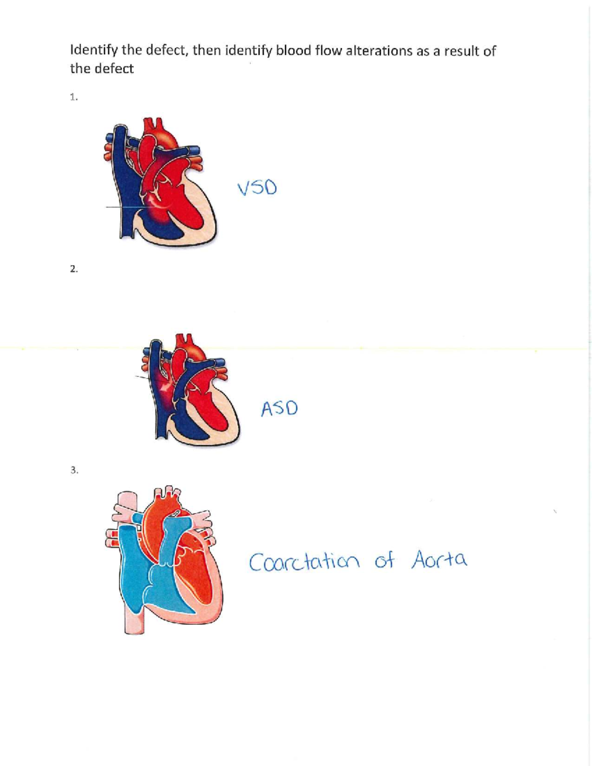 Heart Defect Diagrams KEY: VSD, ASD, Coarctation, and More - Studocu