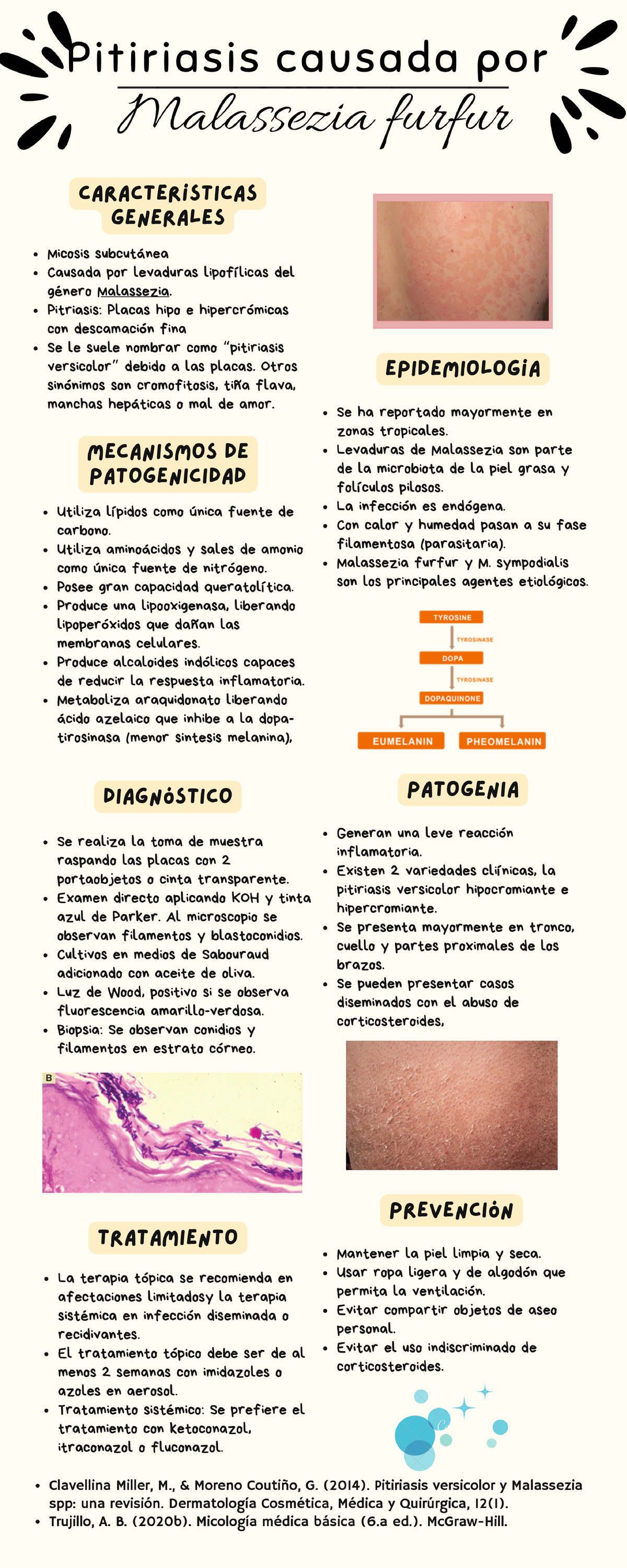Pitiriasis Infografía - Pitiriasis causada por Malassezia furfur ...