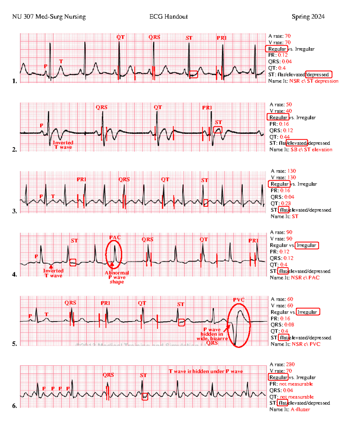 ECG Class Handout - KEY - to practice - NU 307 Med-Surg Nursing ECG ...