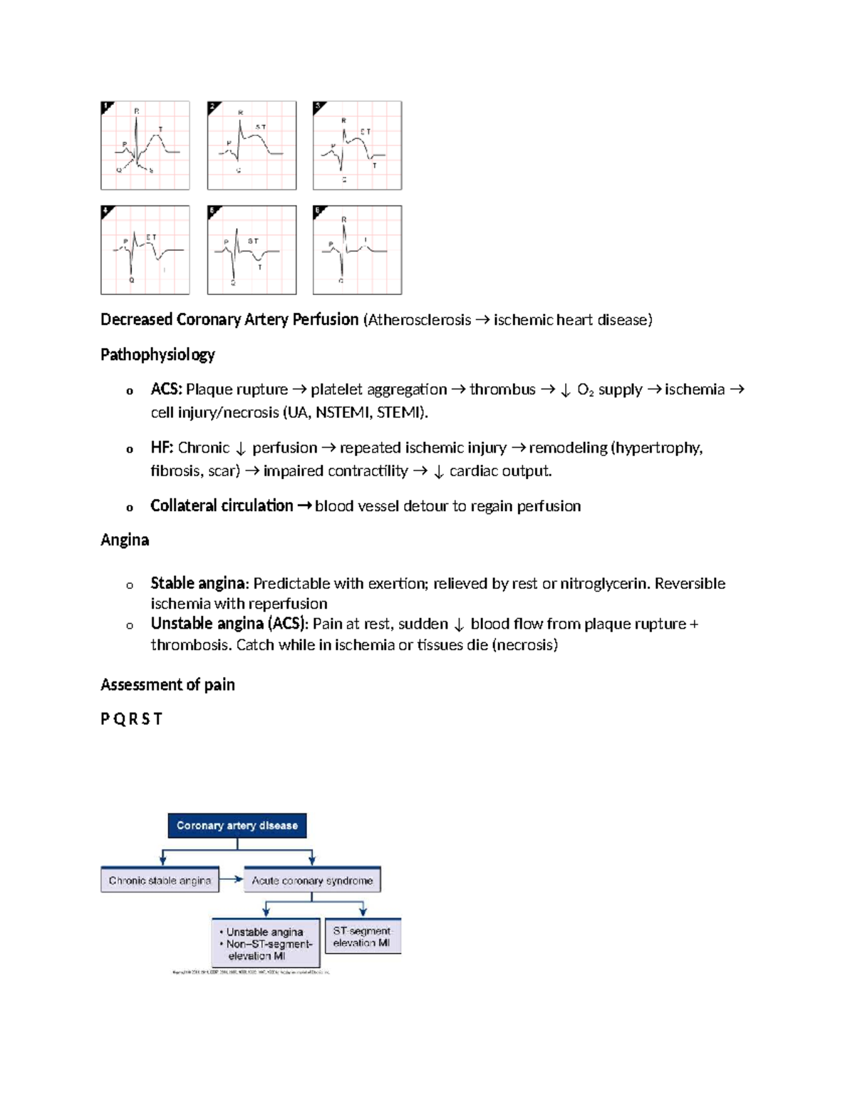 Coronary Artery Perfusion Pathophysiology & Management in ACS - Studocu