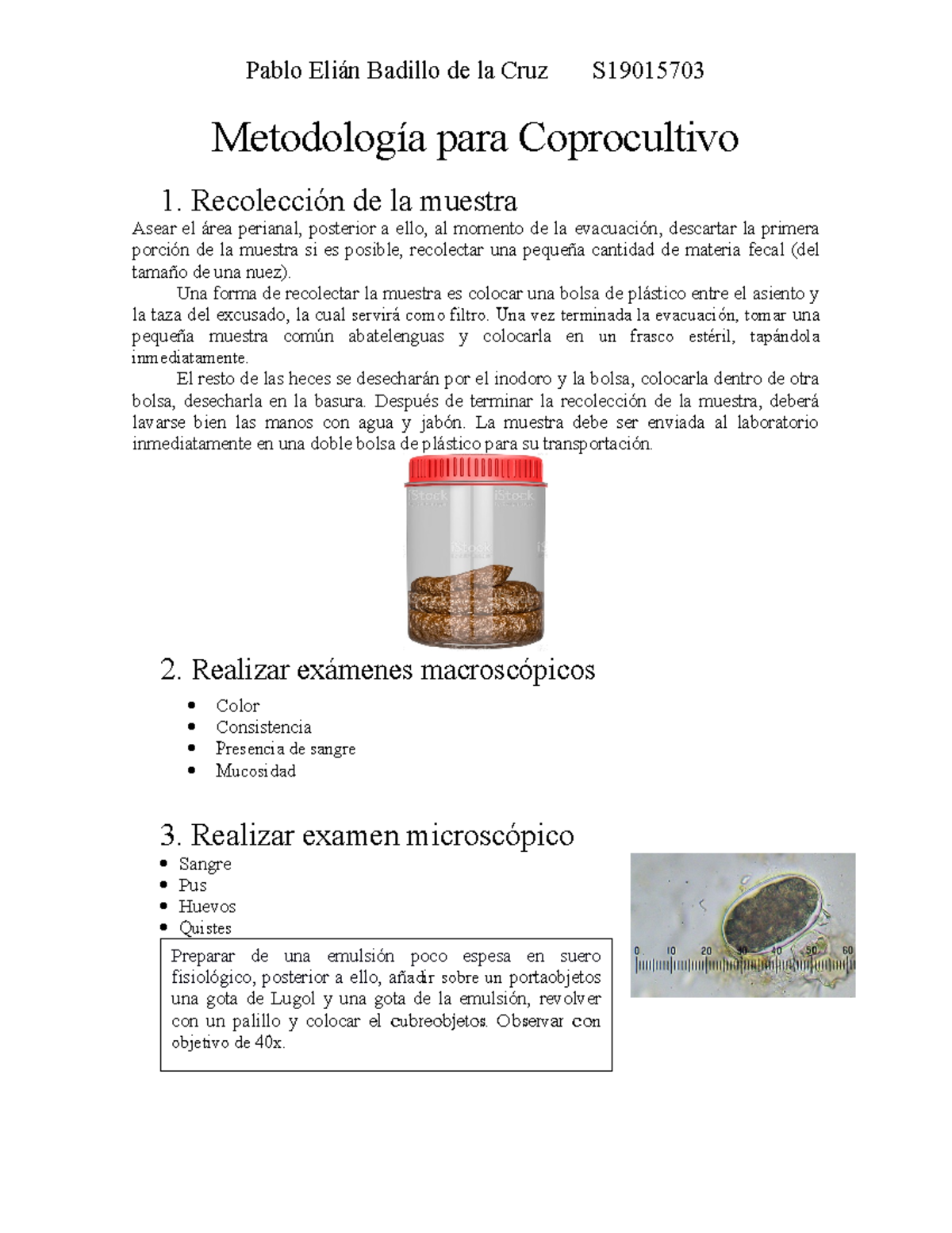 Metodología de Coprocultivo: Guía Práctica para Recolección y Análisis ...