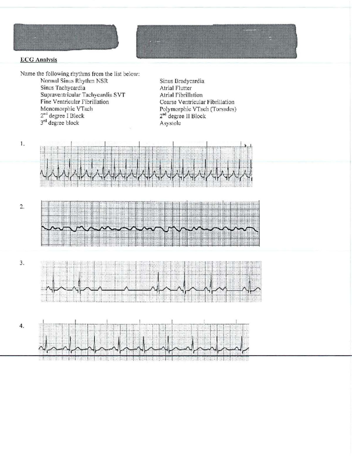 ECG Rhythm Identification Practice - EKG 2025 - Studocu