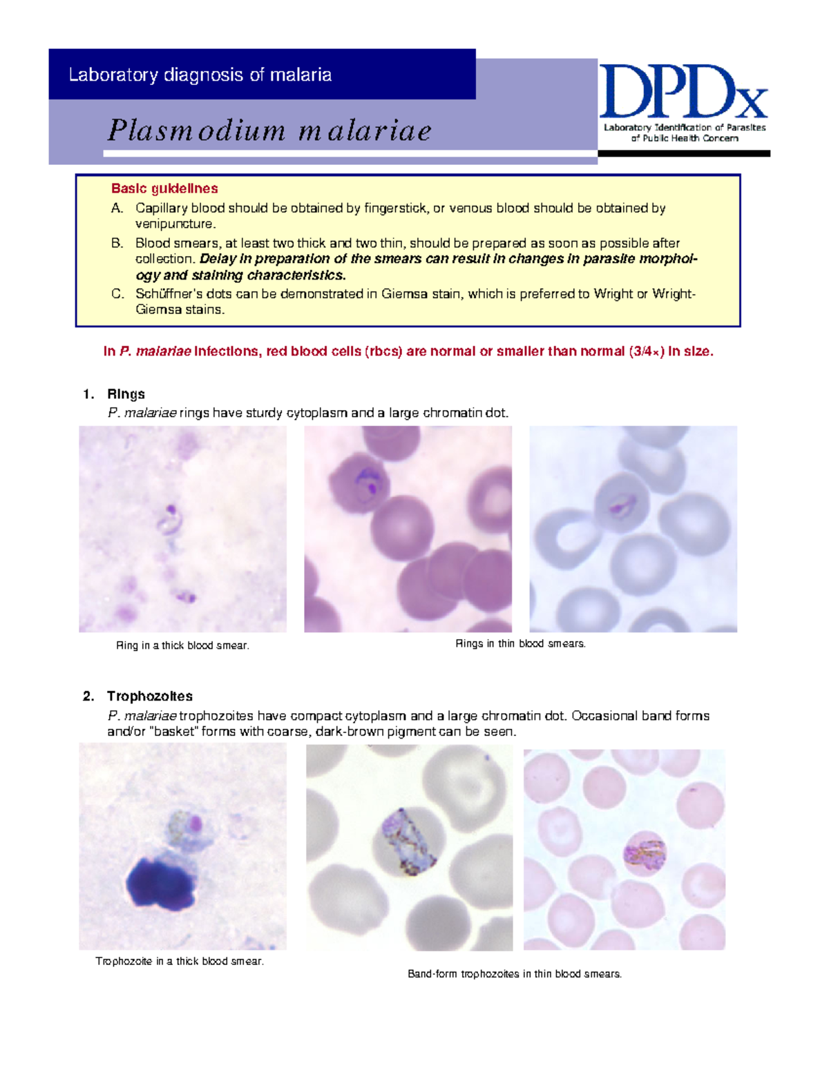 P. malariae Morphology Analysis: Blood Smear Guidelines and Features ...