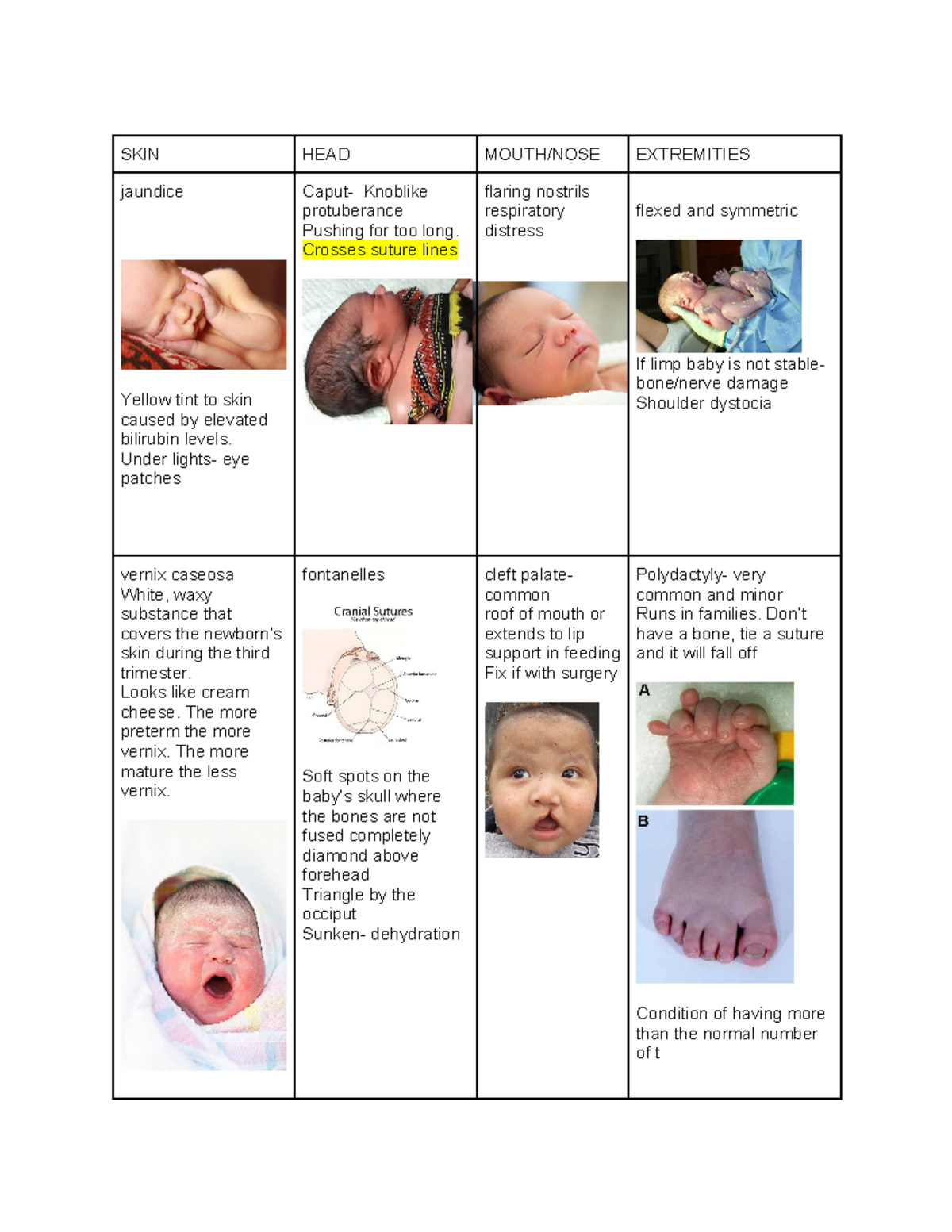Newborn characteristics FA24 - SKIN HEAD MOUTH/NOSE EXTREMITIES ...