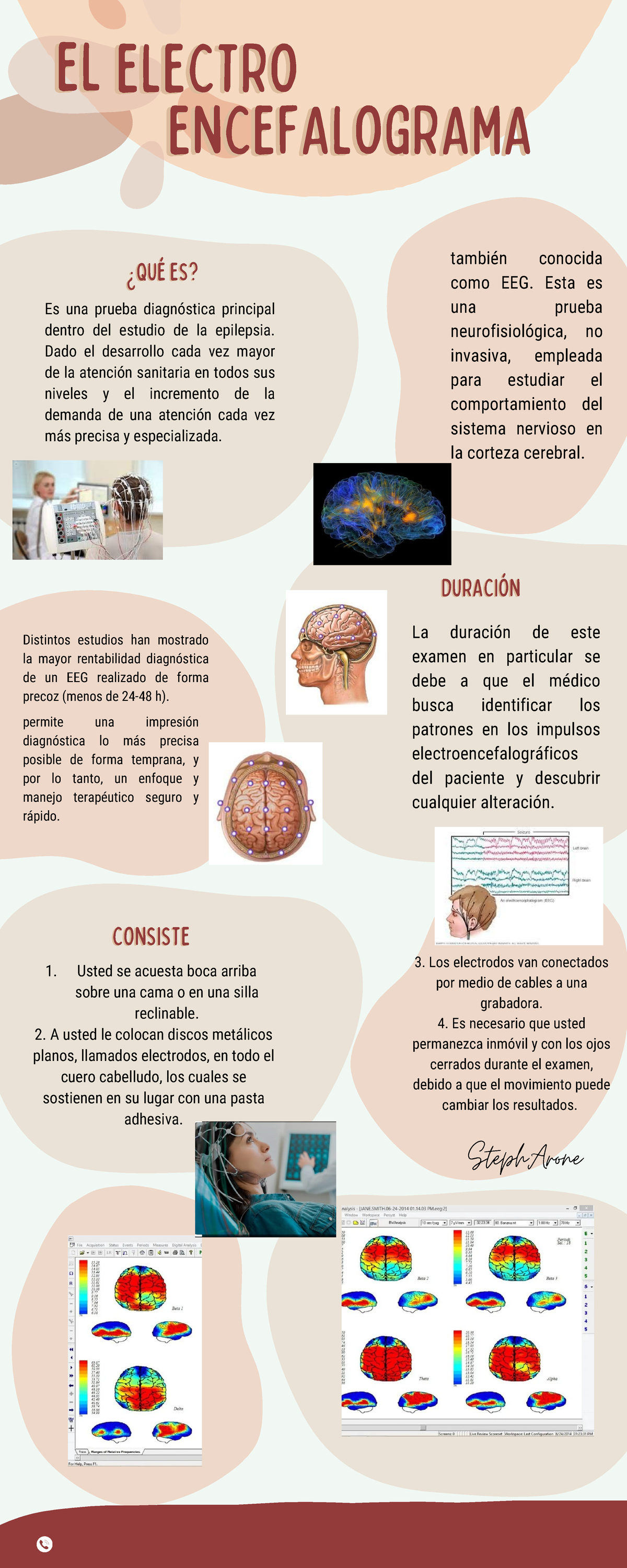 Infografía sobre el Electroencefalograma (EEG) y su Importancia - Studocu