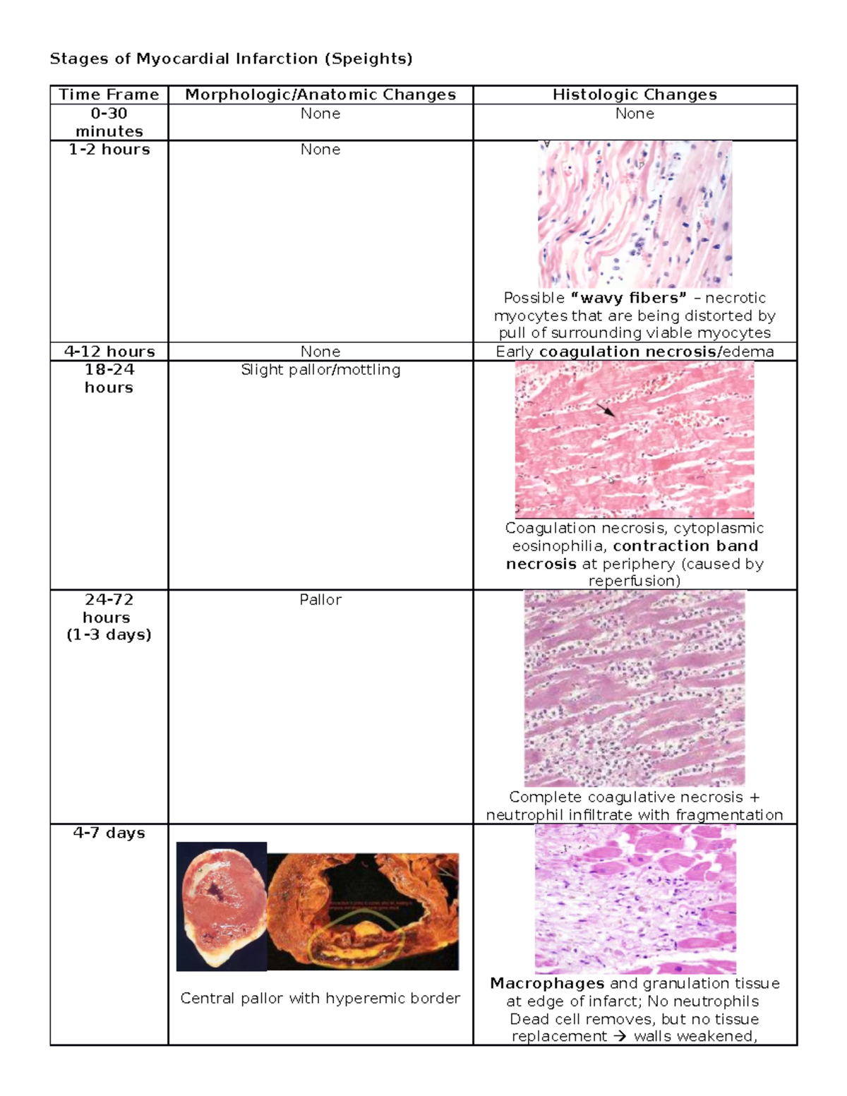 Stages of Myocardial Infarction: Histological Changes Over Time - Studocu
